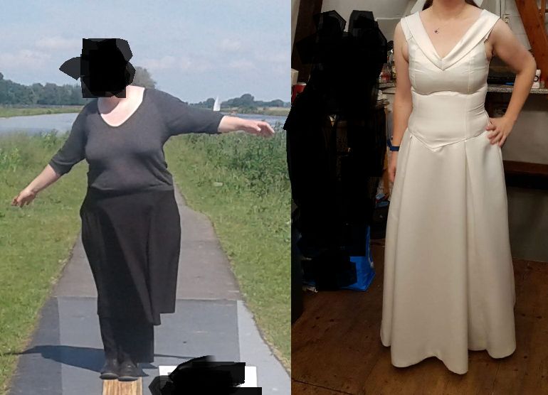 First surgiversary. From 140 to 90 kg. Best decision ever! | Scrolller
