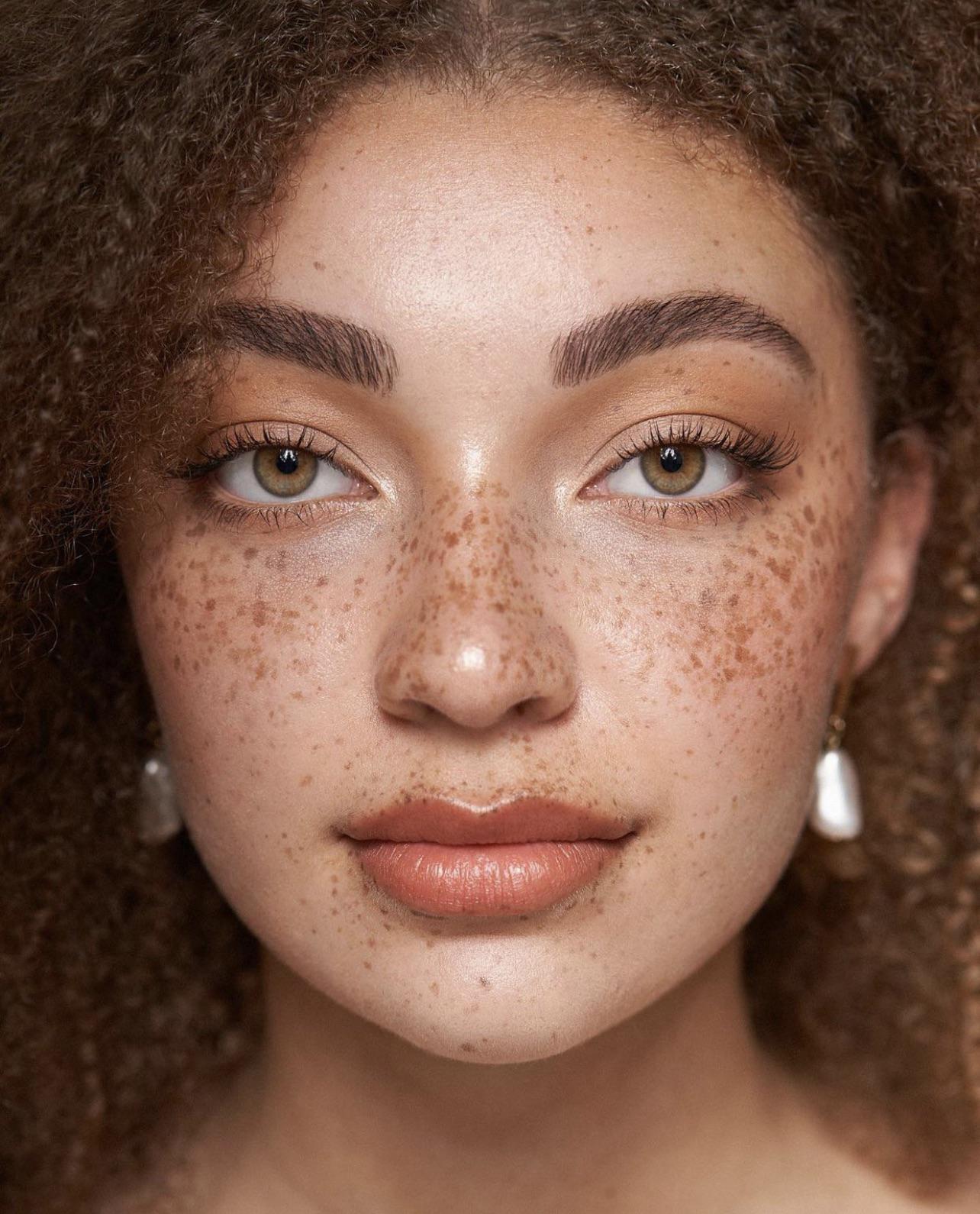 Freckles | Scrolller