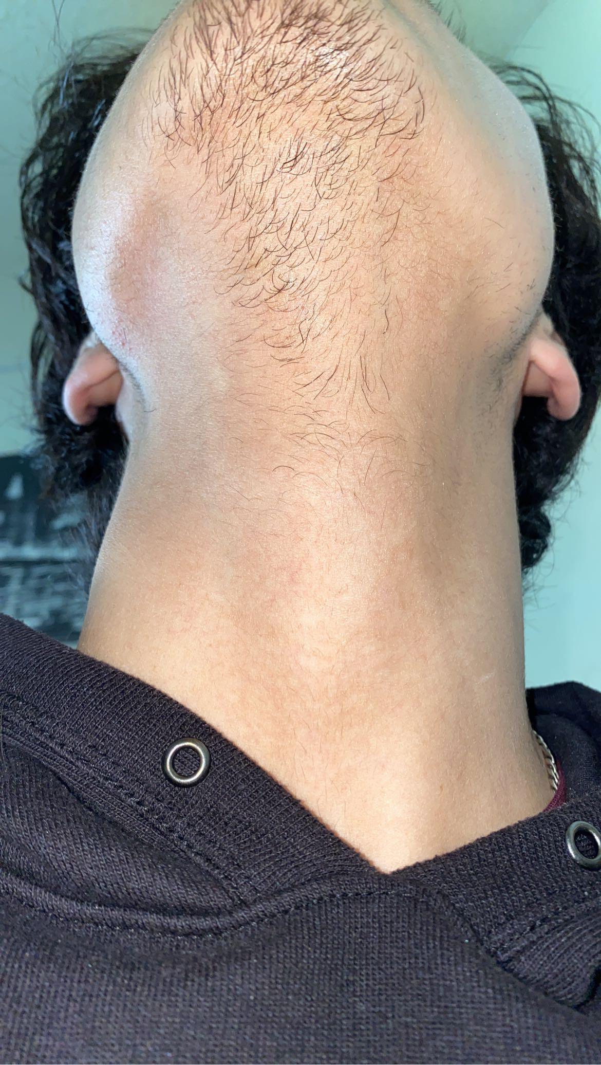 getting started | Scrolller