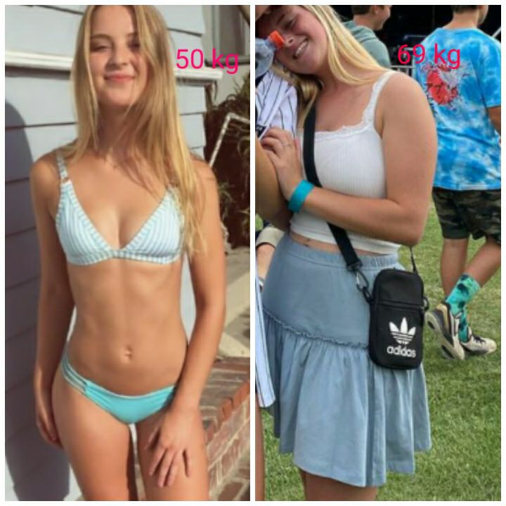 Girl plumped up quick | Scrolller