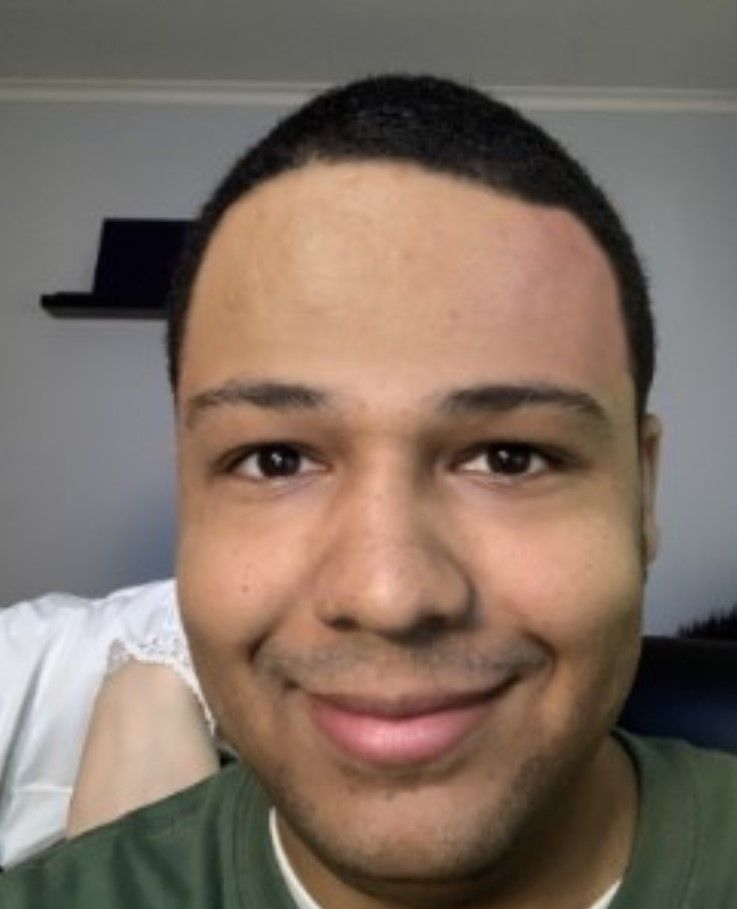 HAIRLINE OMEGALUL | Scrolller