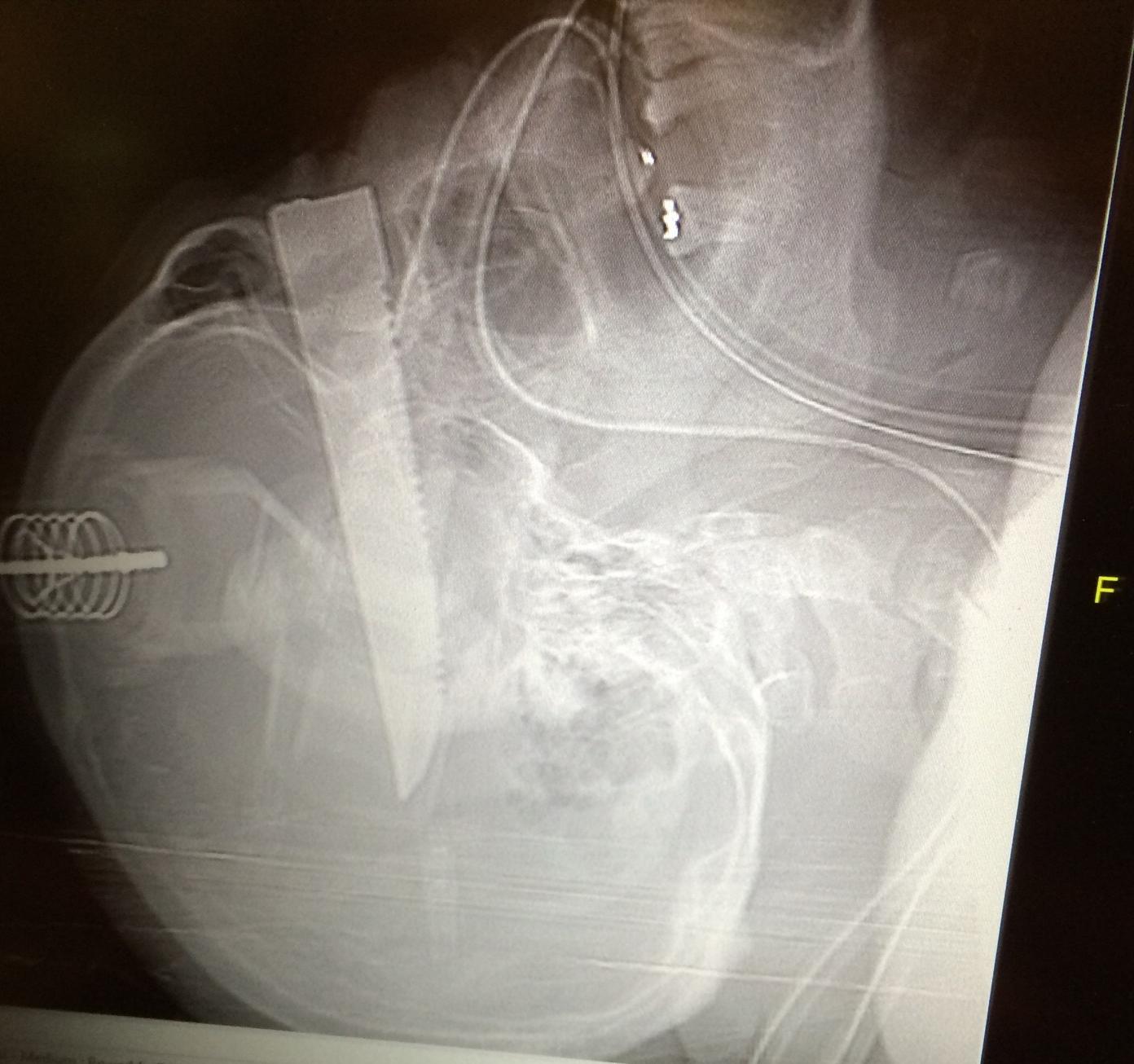 Head trauma | Scrolller