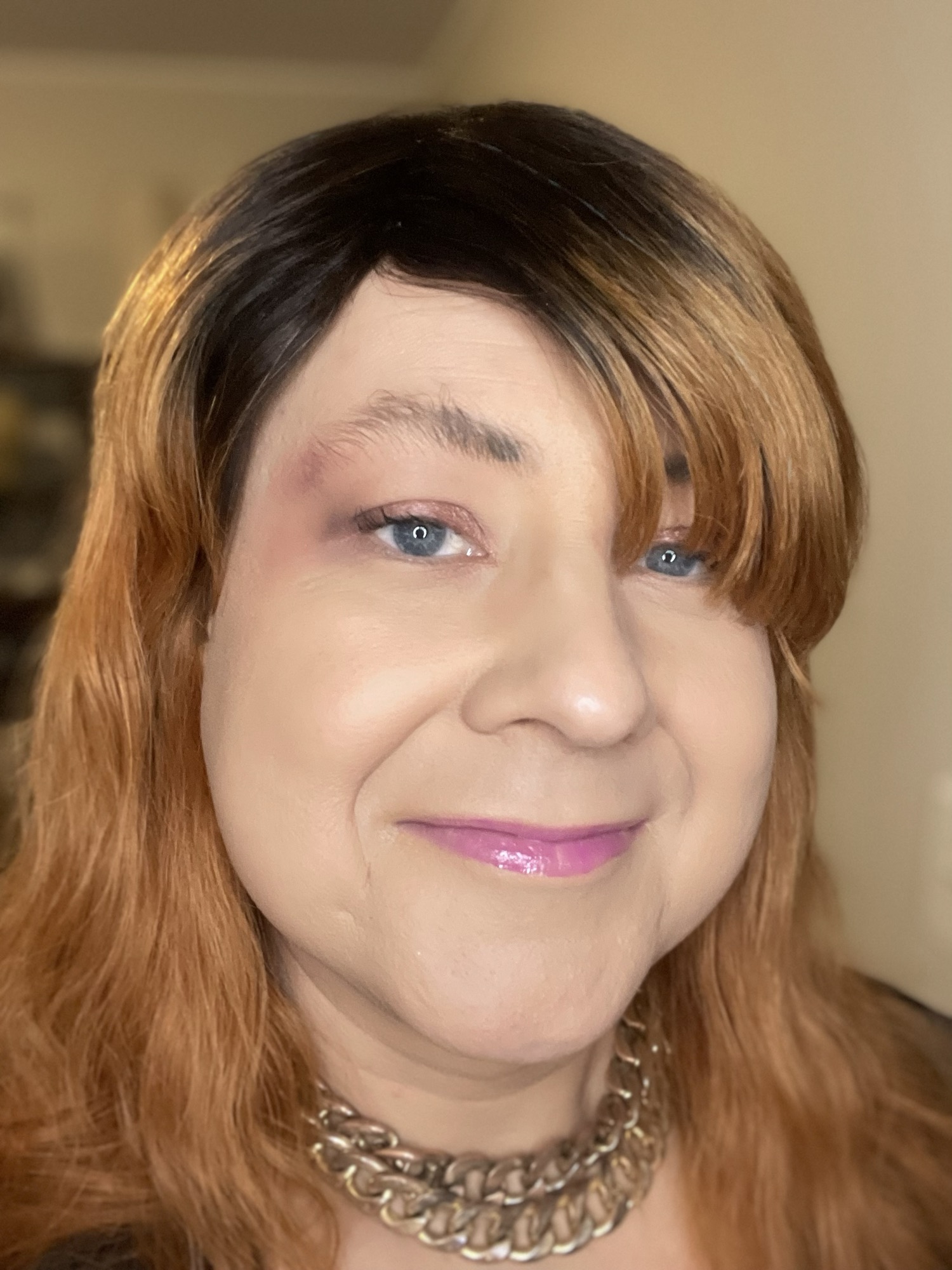 hello, police? There’s been a murder! It was me, I’m killing it. Two months HRT | Scrolller