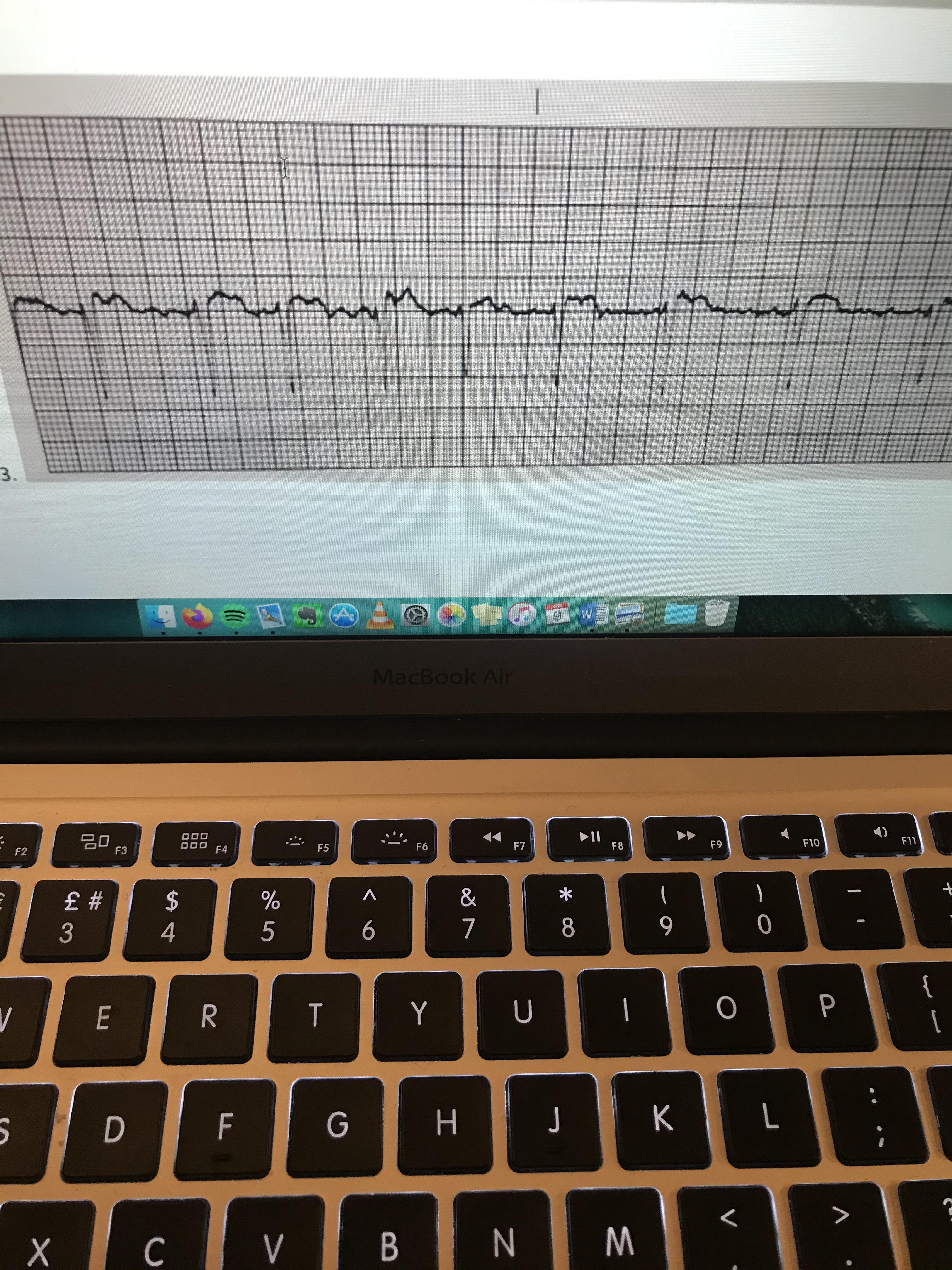 Help with interpretation of rhythms | Scrolller