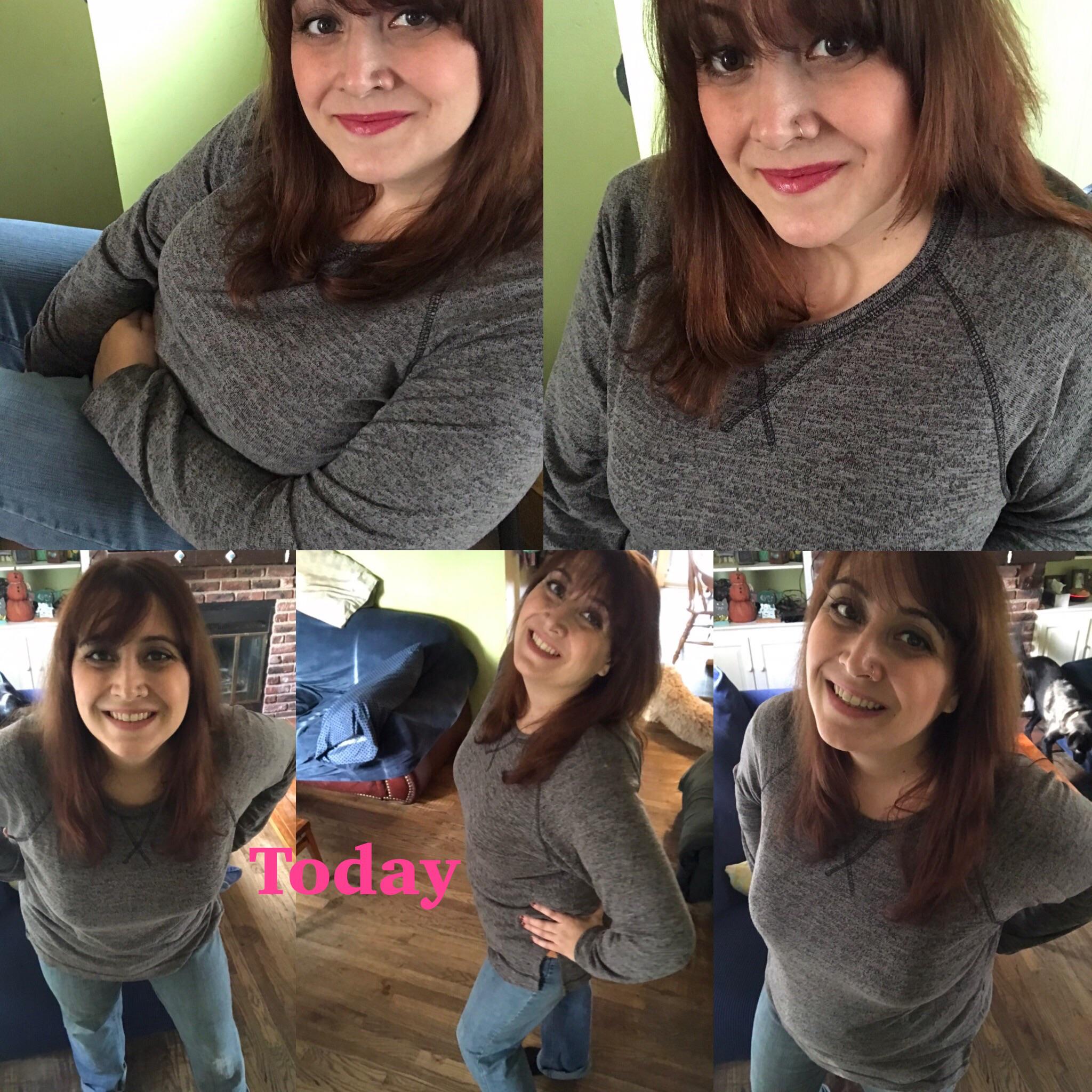 Here’s some progress pictures from today. I am almost 6 months post op for Roux-en-Y. | Scrolller