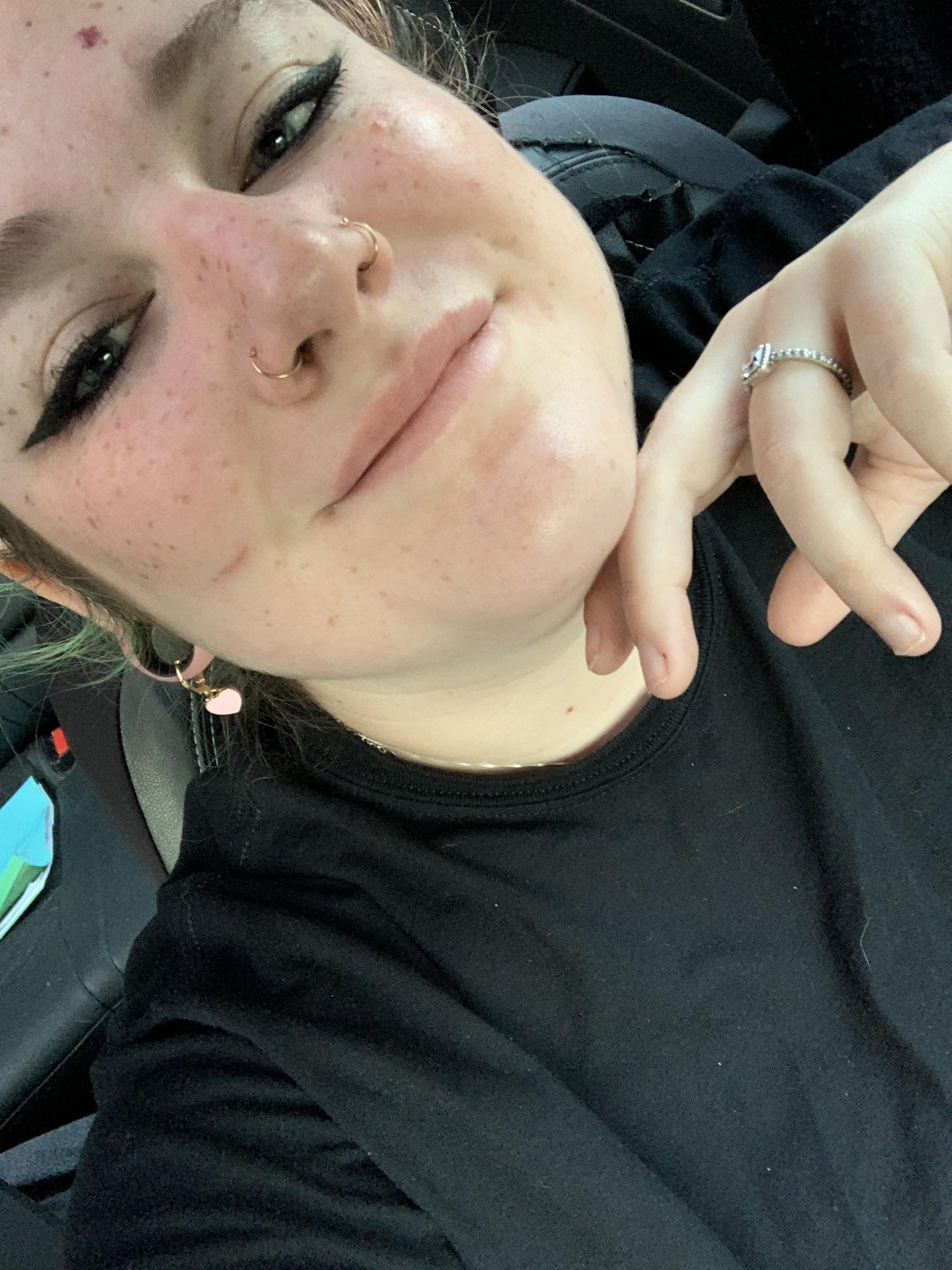 Hiiiiiii from a freckled face 🖤 | Scrolller