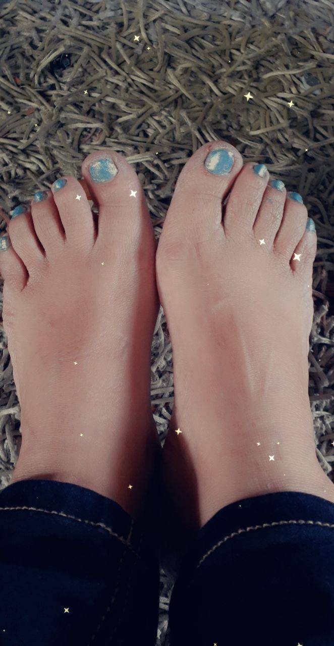 Hit the ^arrow if you like my feet, I just painted my toes. | Scrolller