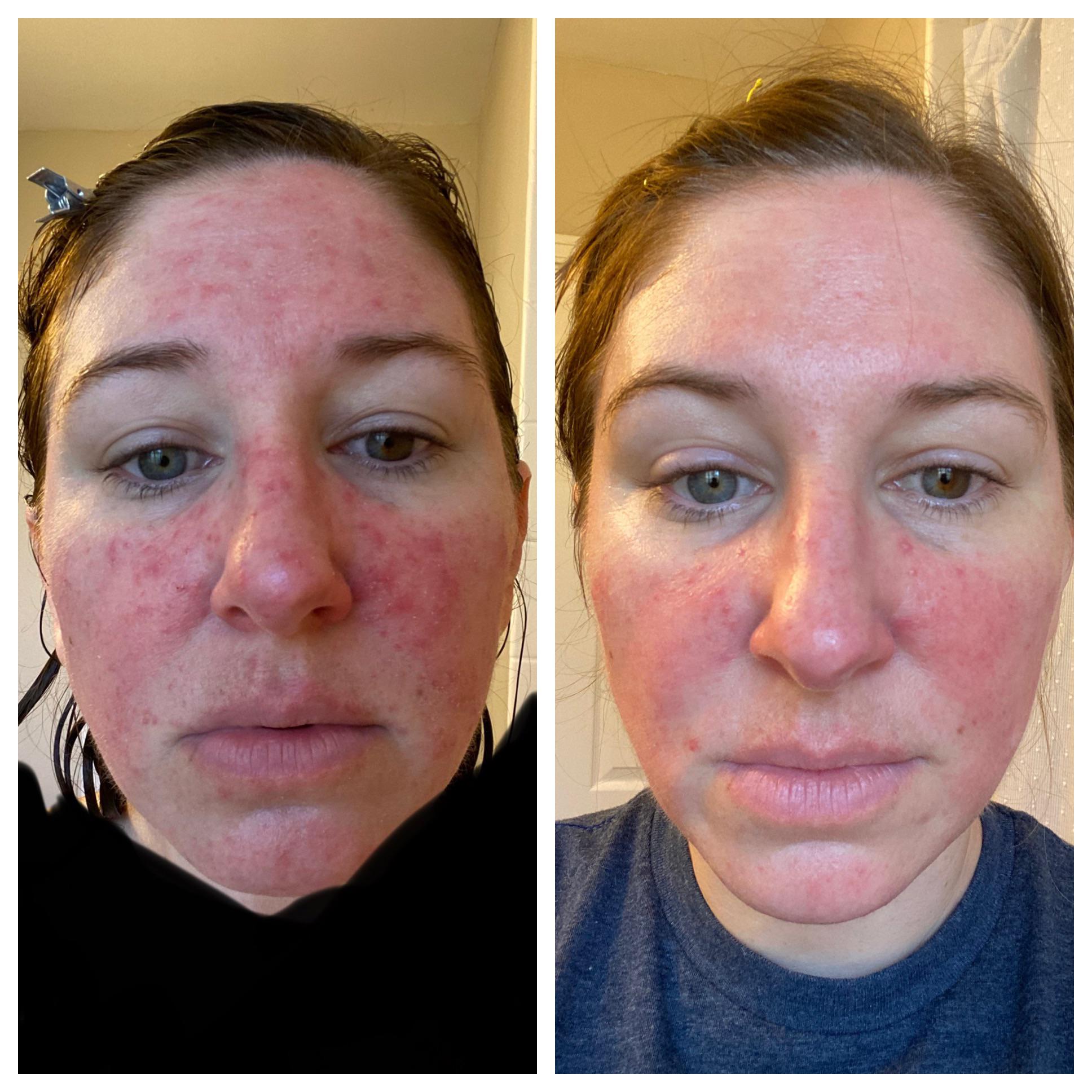 Horse paste progress - one week! | Scrolller