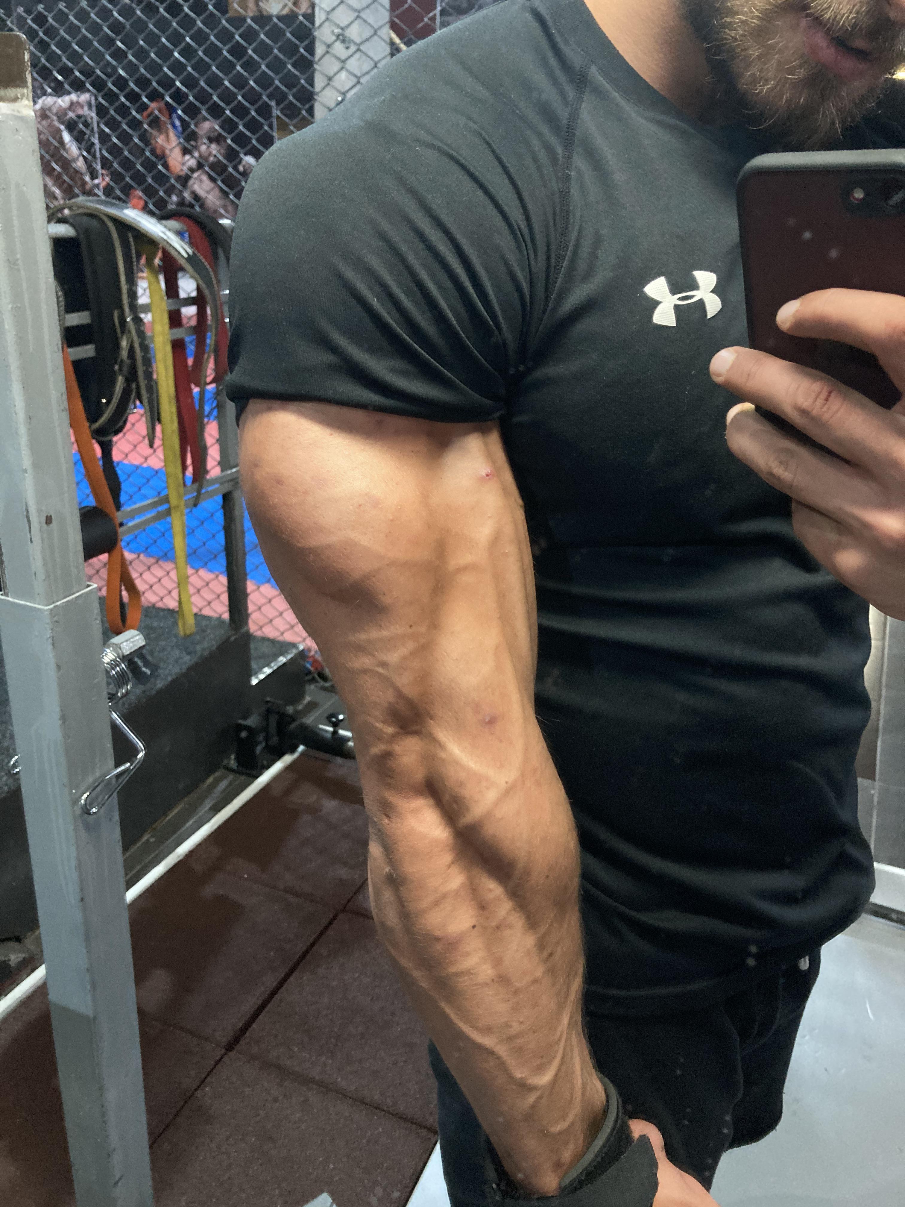 Hows the forearm? | Scrolller