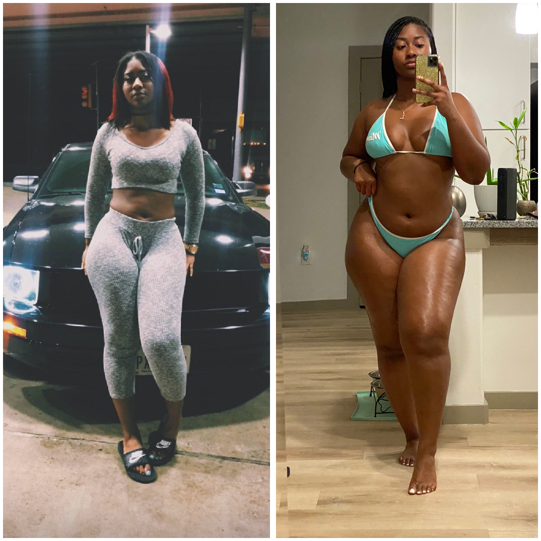 Huge weight gain | Scrolller