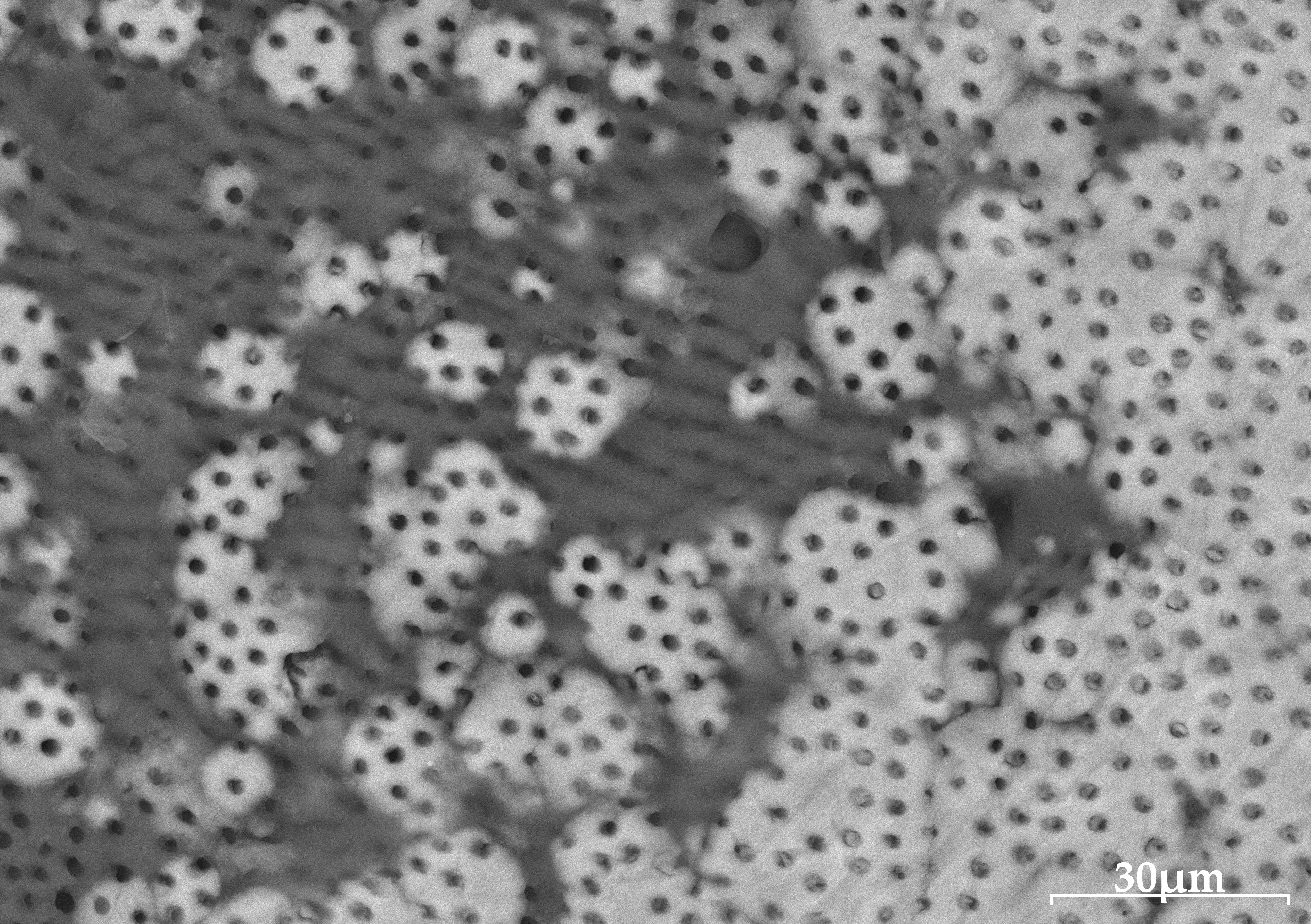 Human tooth thinsection, SEM | Scrolller