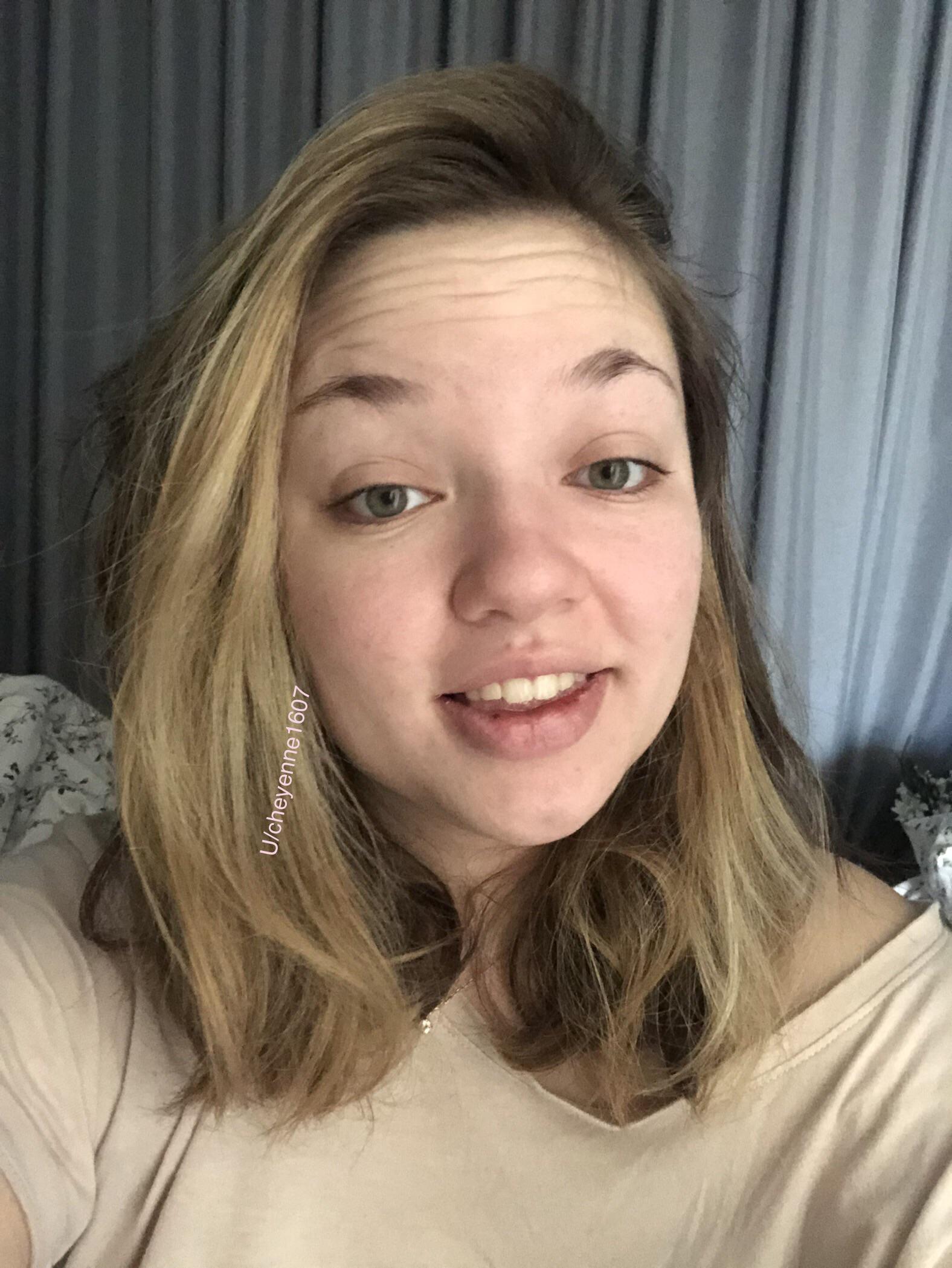 I bumped my head so hard yesterday 😅 I really am a dumb dumb 🙈F/22 | Scrolller