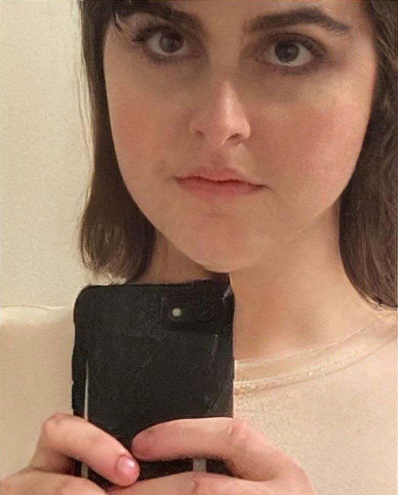 I’m nervous | Scrolller