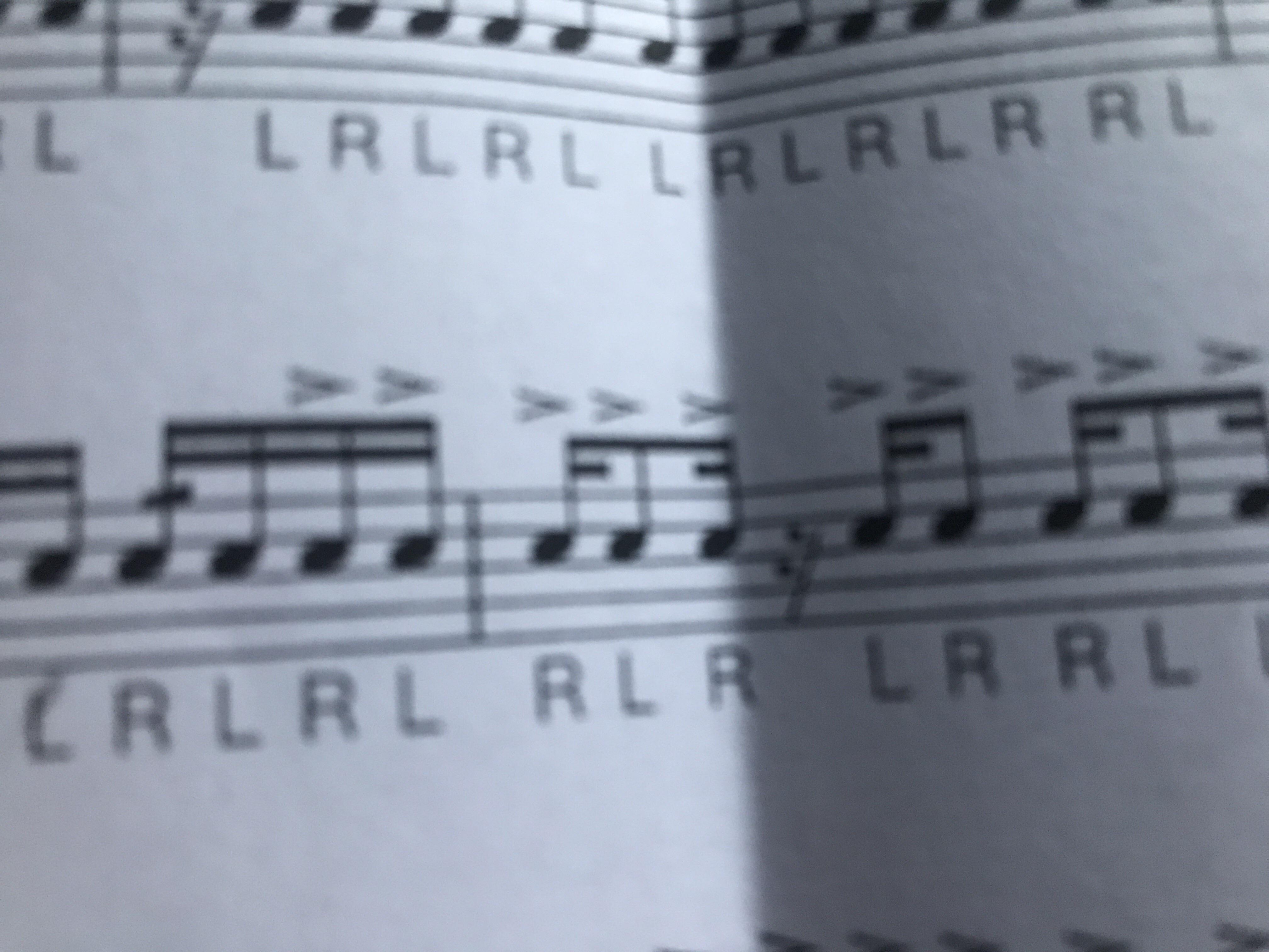 I totally forgot what these are called and I have trouble with searching the internet. What is ...