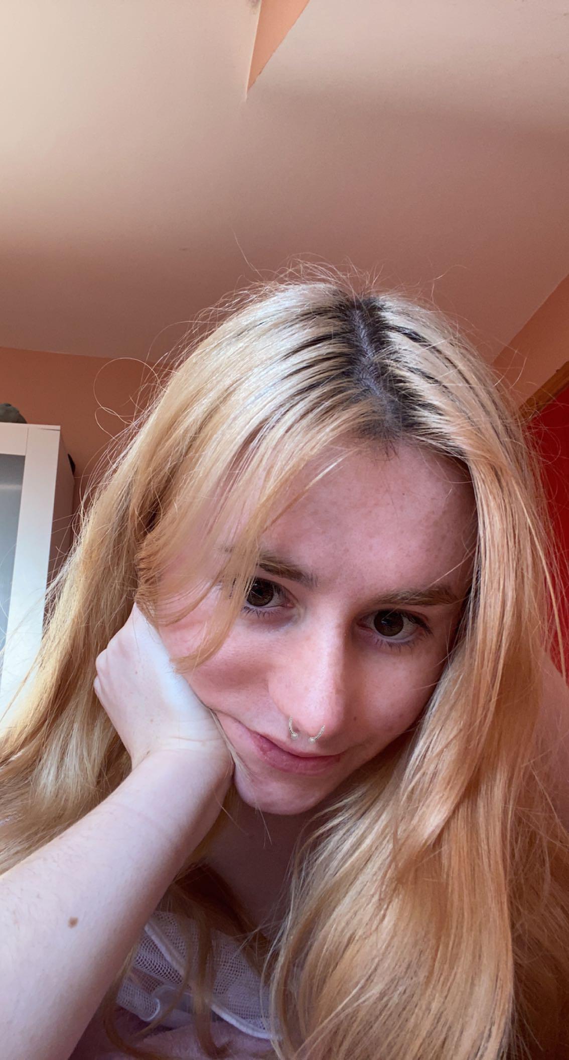 I used to hate my freckles, now I’m learning to embrace them ️ | Scrolller I used to hate my freckles, now I’m learning to embrace them ️ | Scrolller