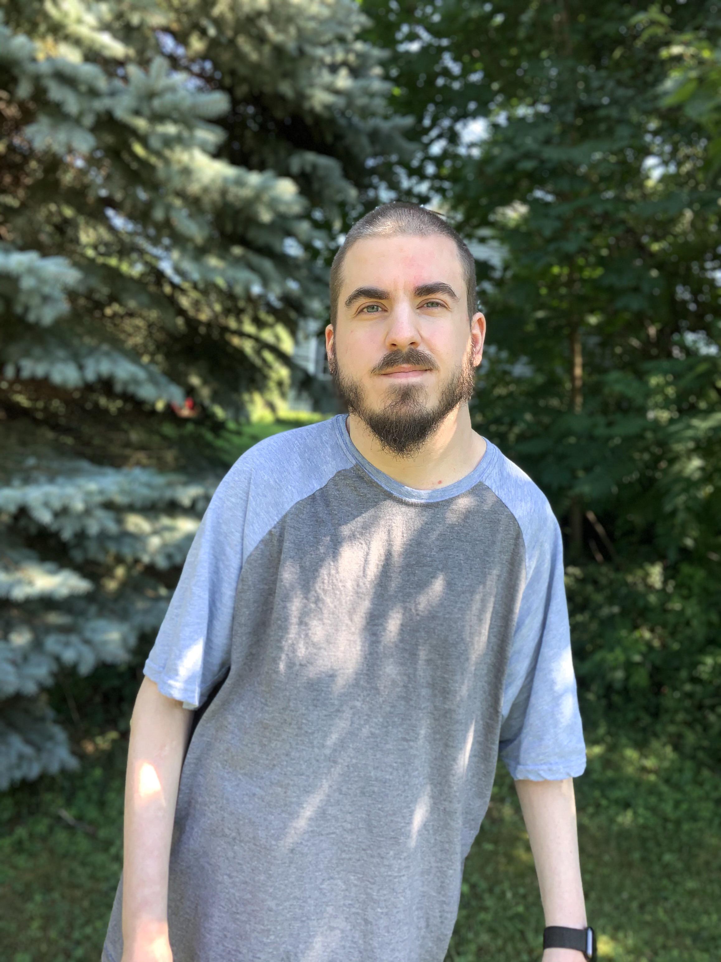 It’s been a 27 year journey accepting my nerve condition/scoliosis and my skinny frame. I try to ...