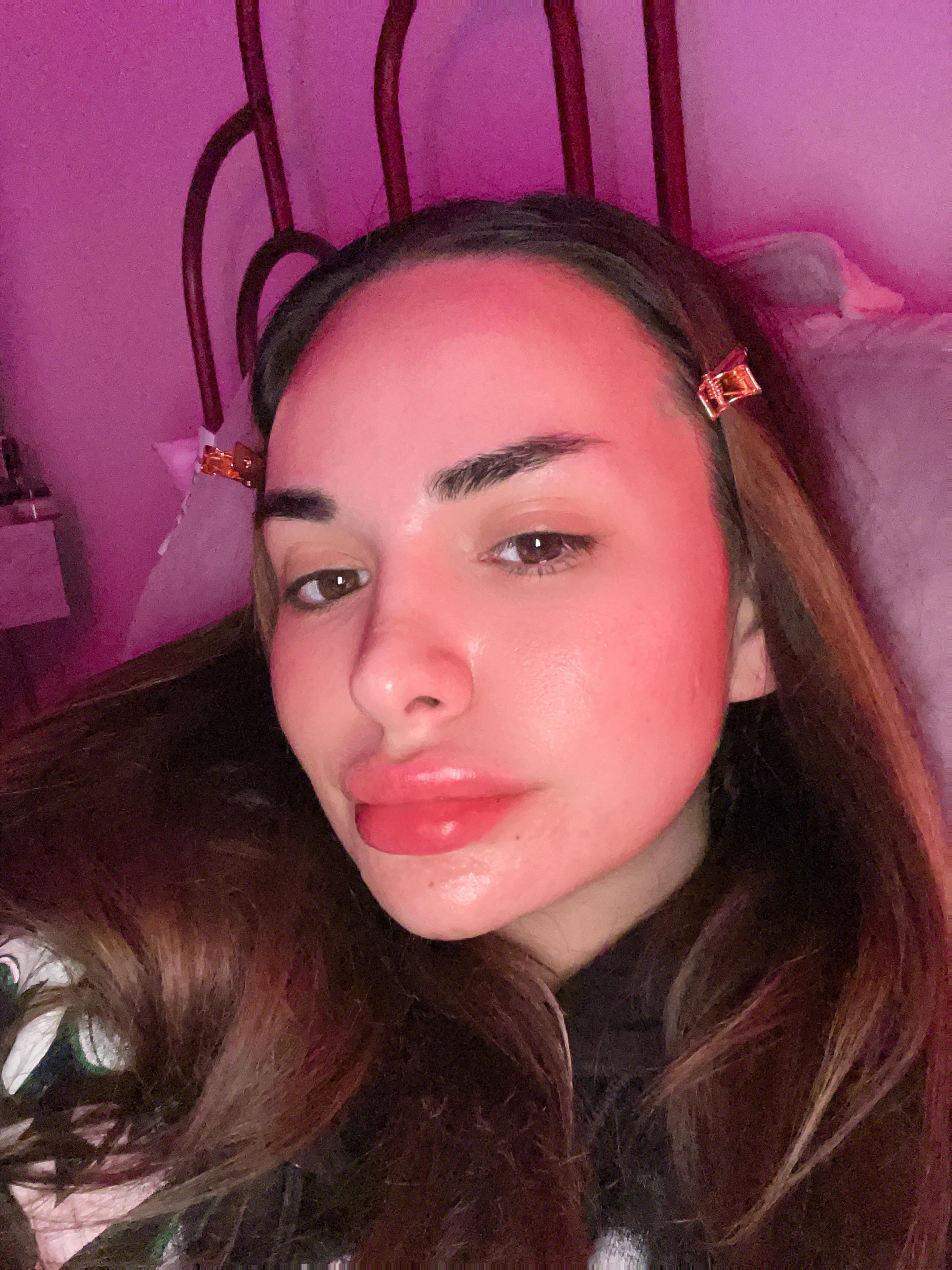 I wish my lips stayed swollen like this !! lol I guess time for another syringe or 2 👄💉 | Scrolller