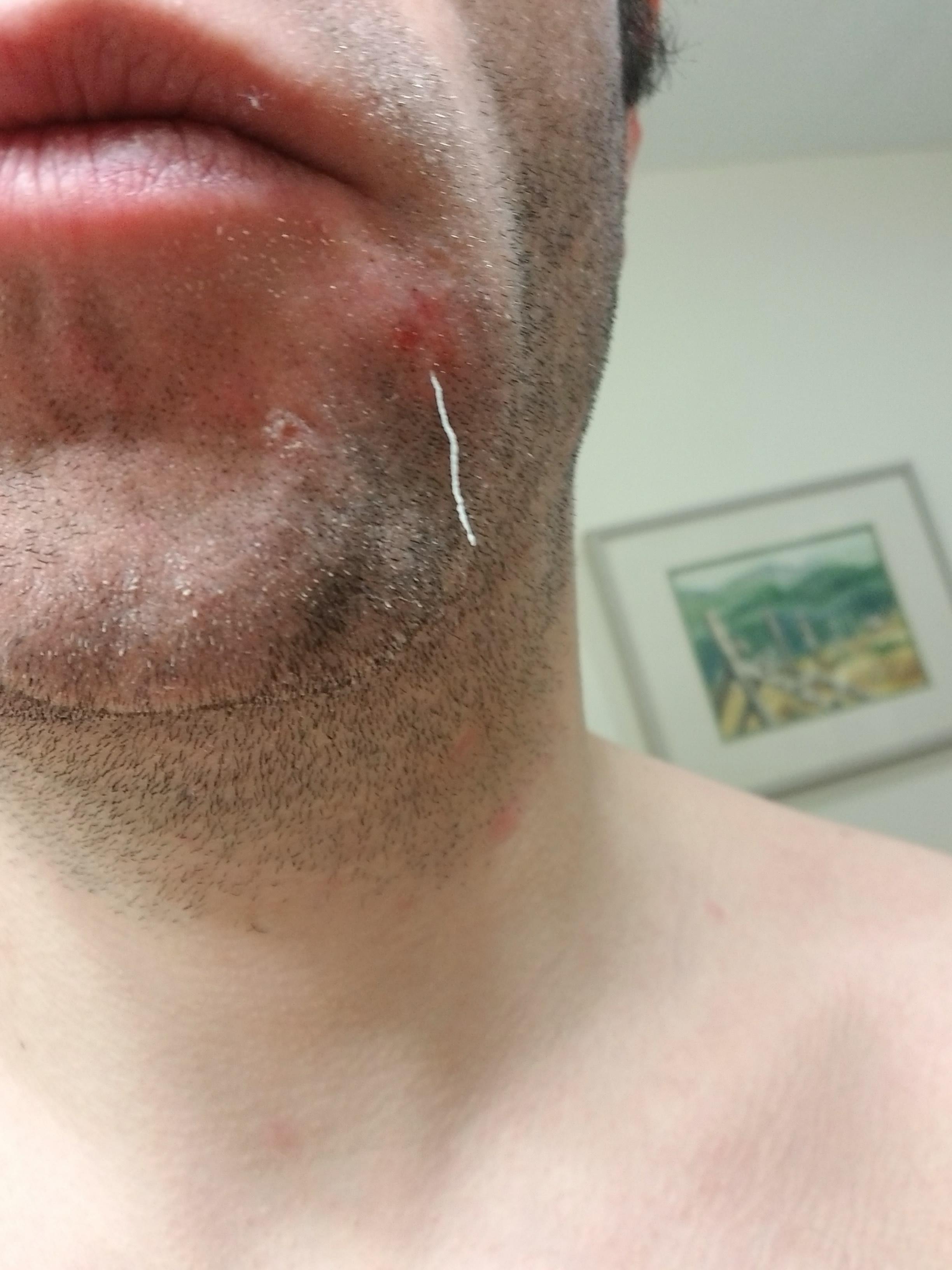 I wondered why this spot bugged me for years... | Scrolller