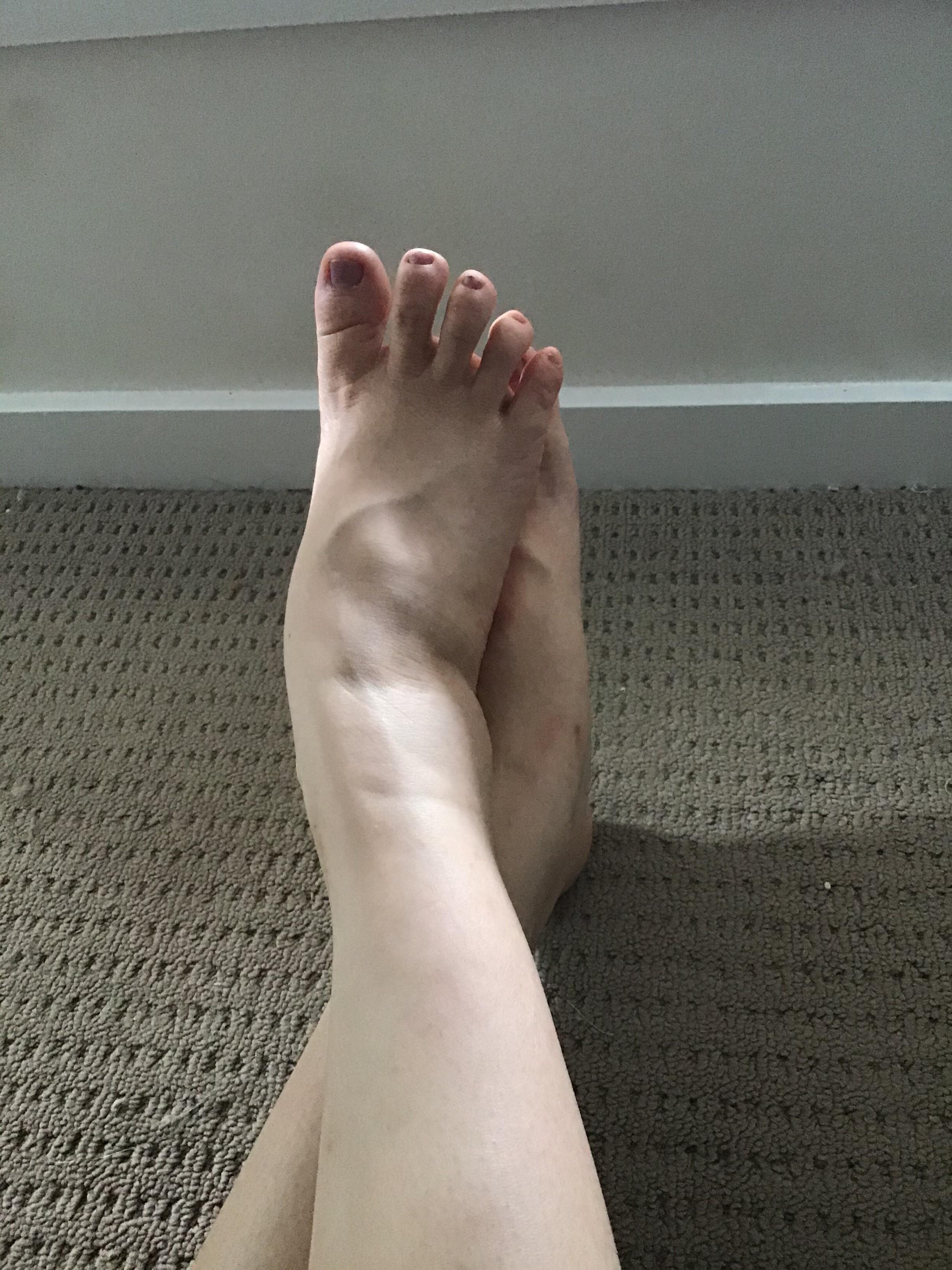Imagine rubbing my feet🤤 | Scrolller