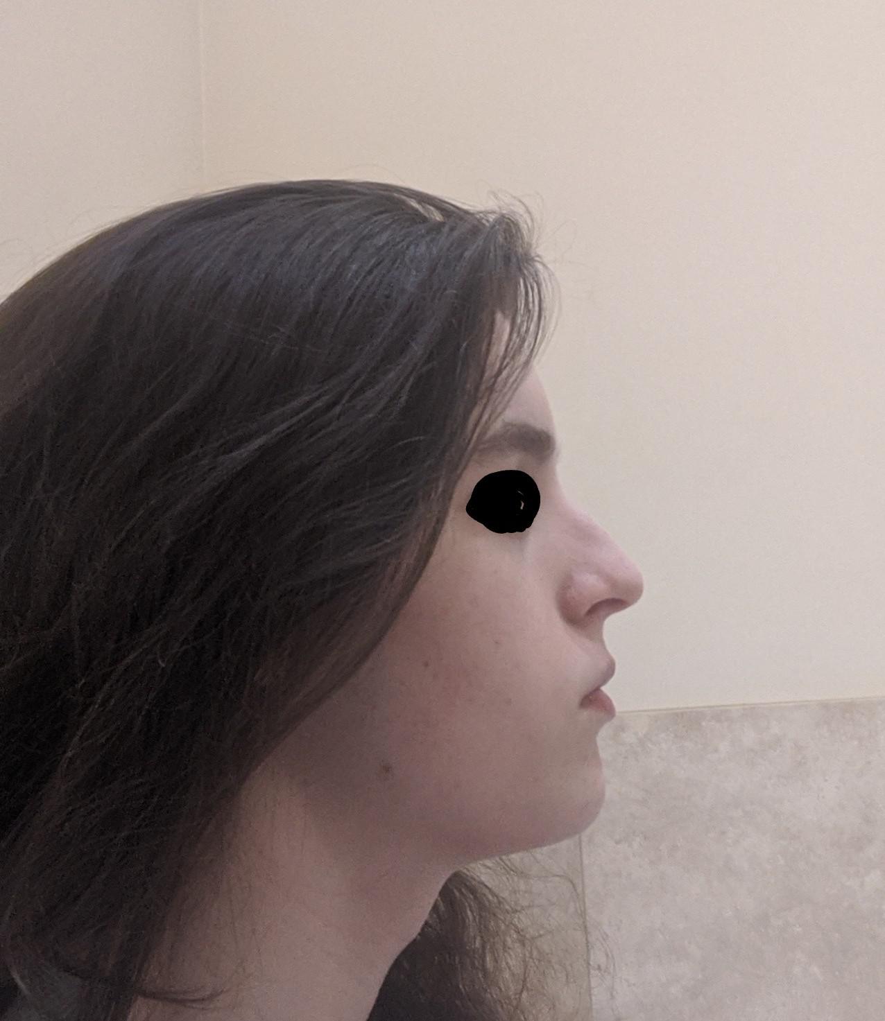 Is this considered a "strong" brow ridge? I don't really get what I'm looking for... | Scrolller