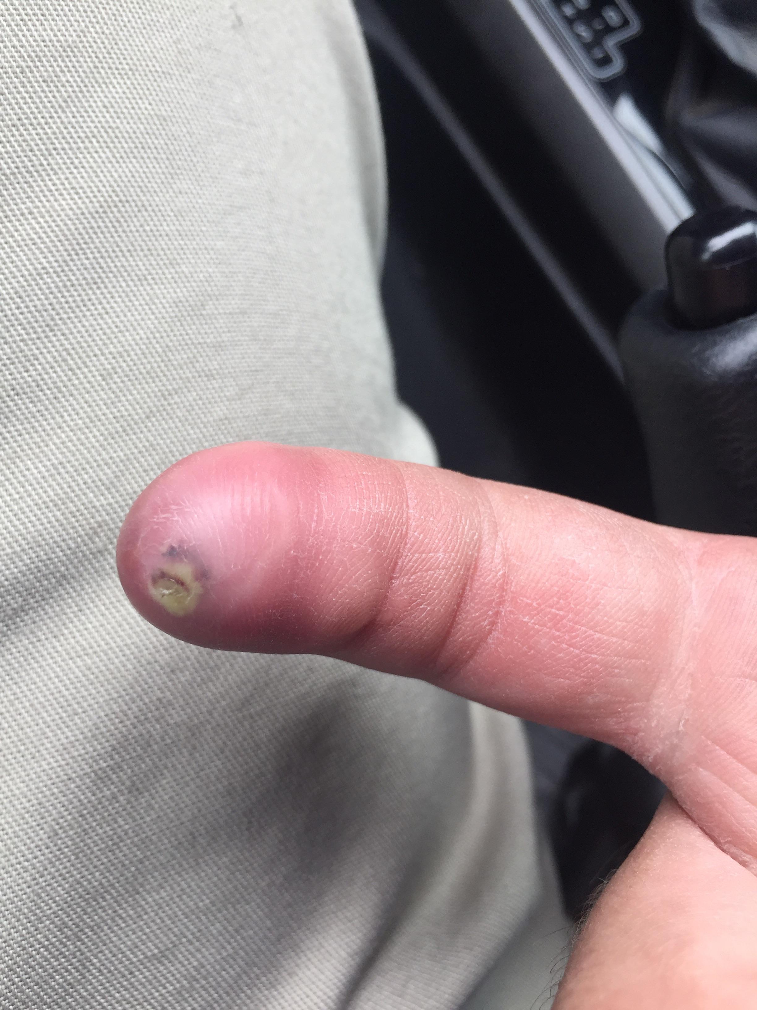 Is this infected? | Scrolller