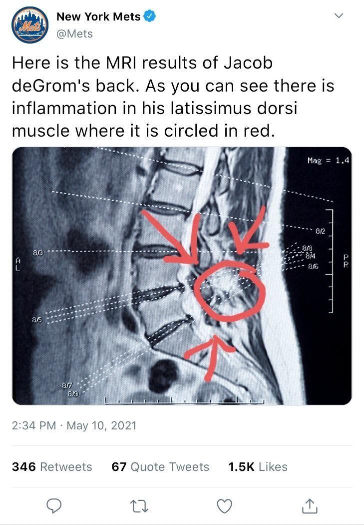 Jacob’s apparent MRI | Scrolller