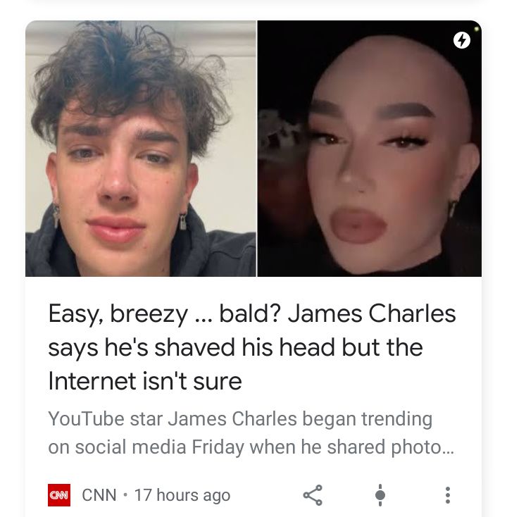 James charles wants to go bald 🤔 Thoughts on that 🤨 | Scrolller