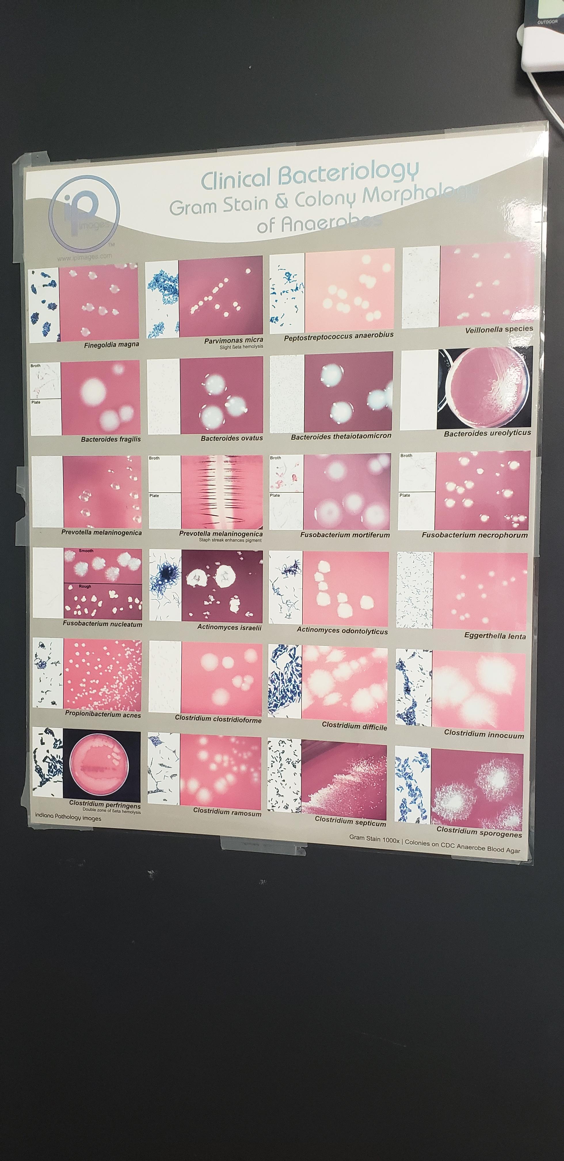 Just a chart | Scrolller