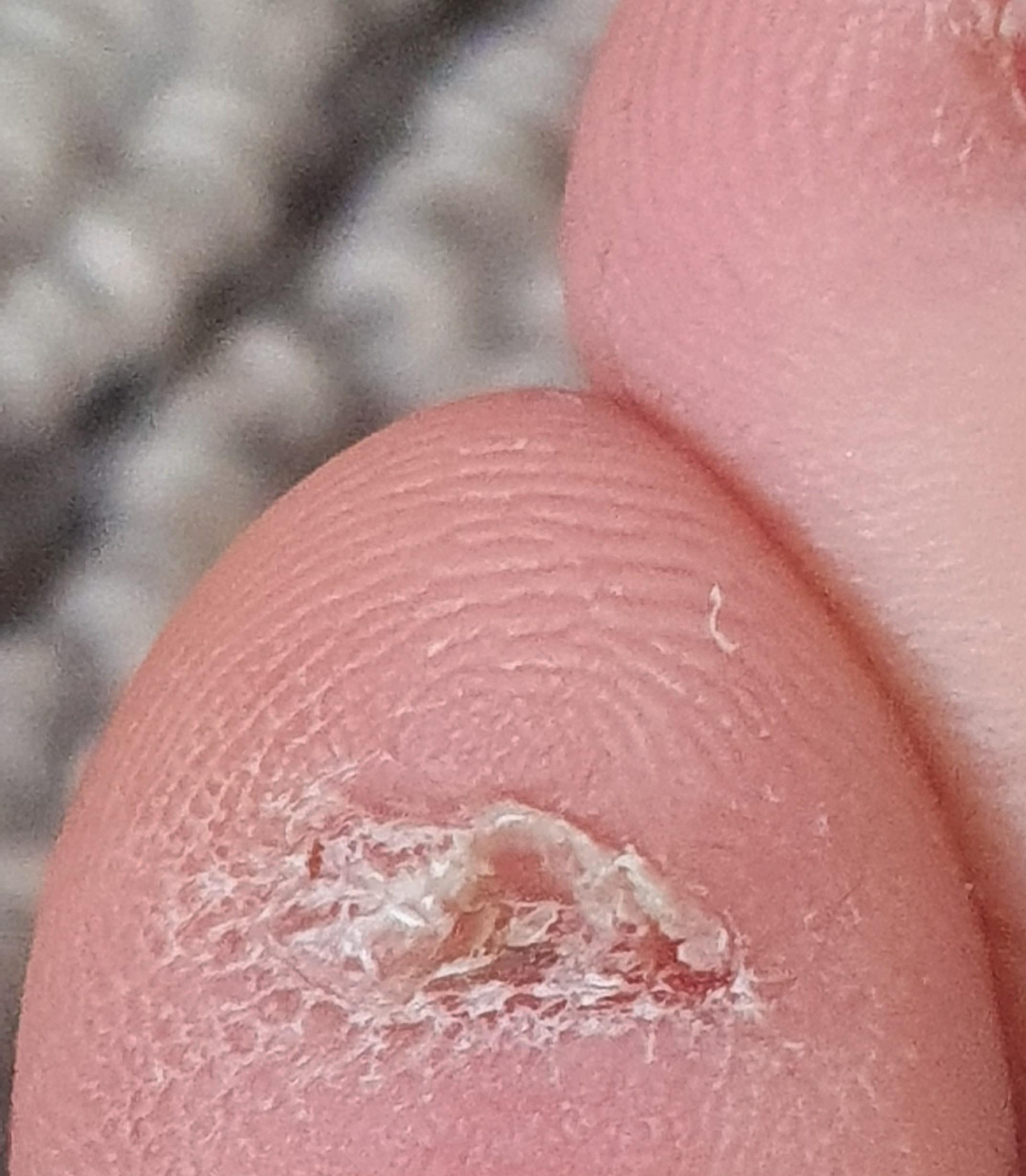 Just The Tip | Scrolller