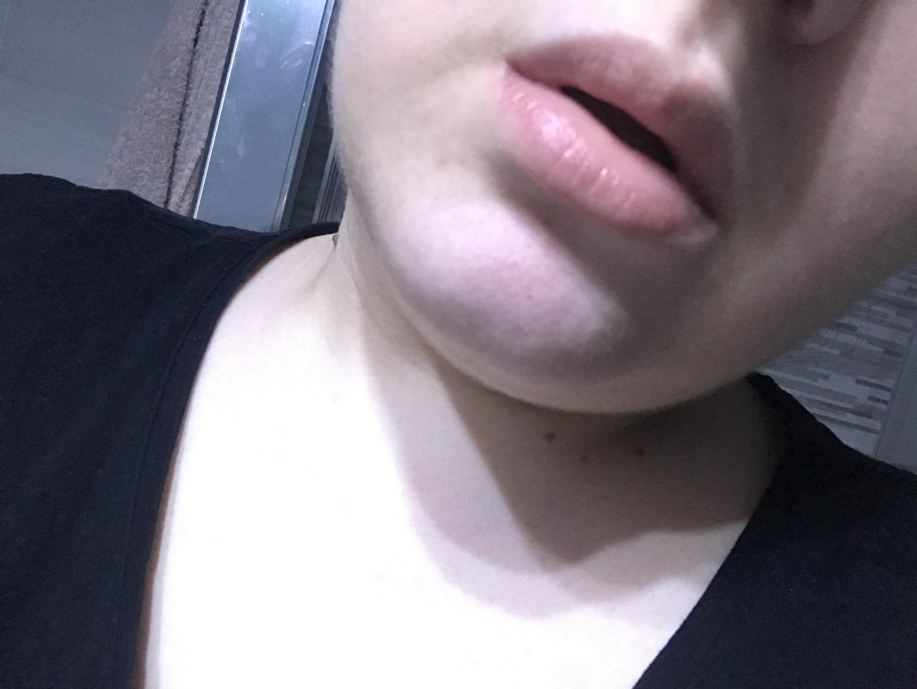 Kisses 👄 Scrolller