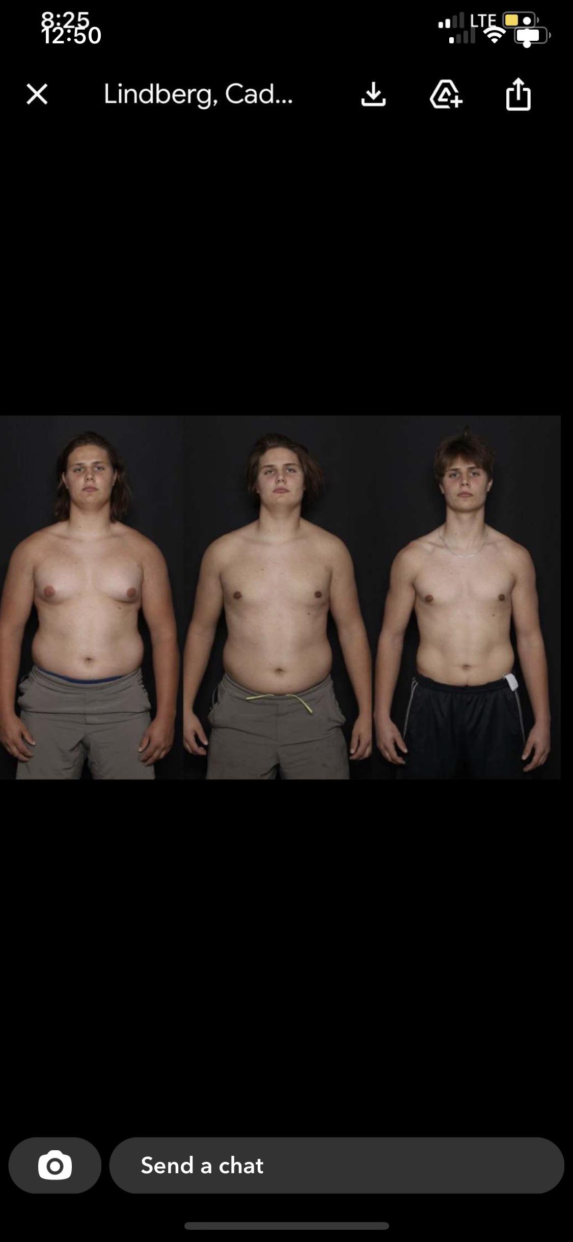 Last appointment with my surgeon the other day! 6 months | Scrolller