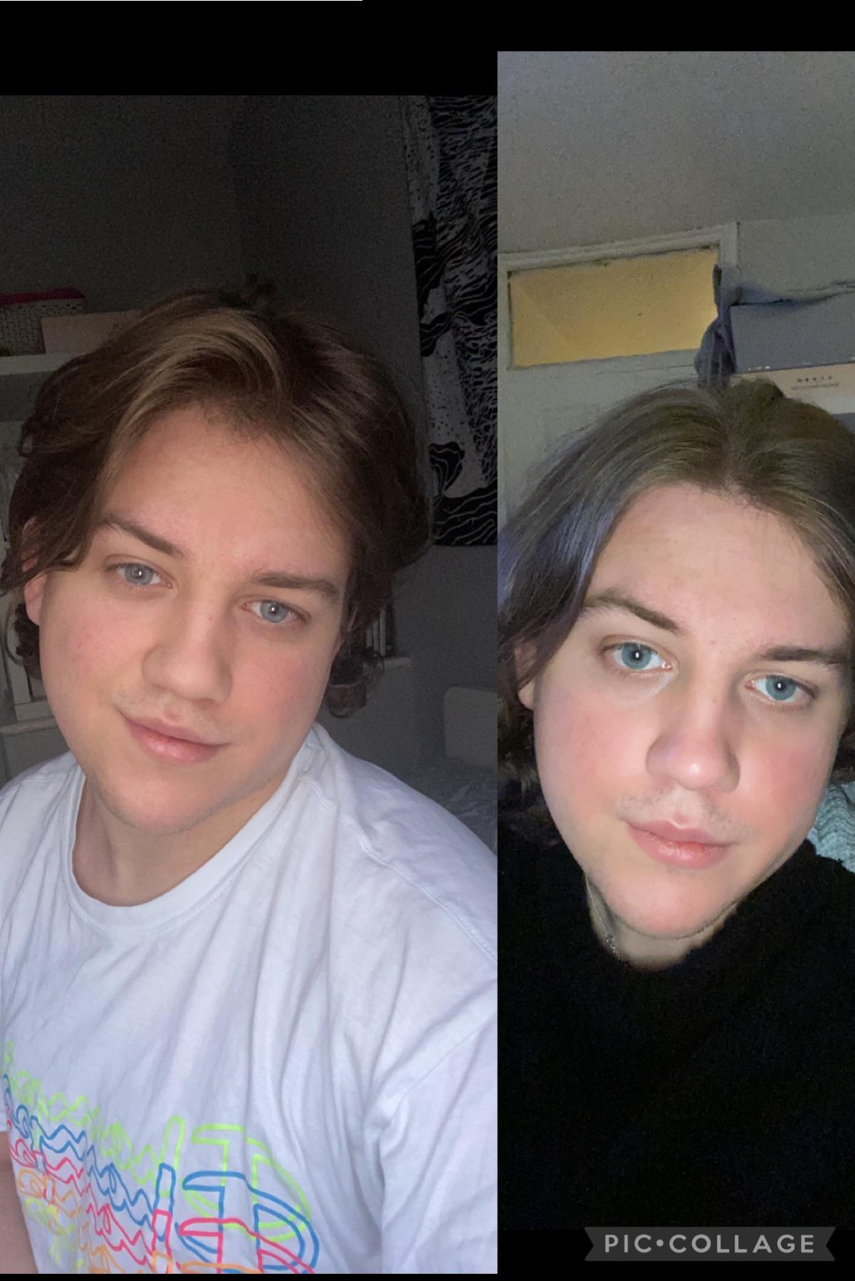 Left, pre HRT. Right, ~3 months HRT. The changes are slow but I think I ... Left, pre HRT. Right, ~3 months HRT. The changes are slow but I think I ...