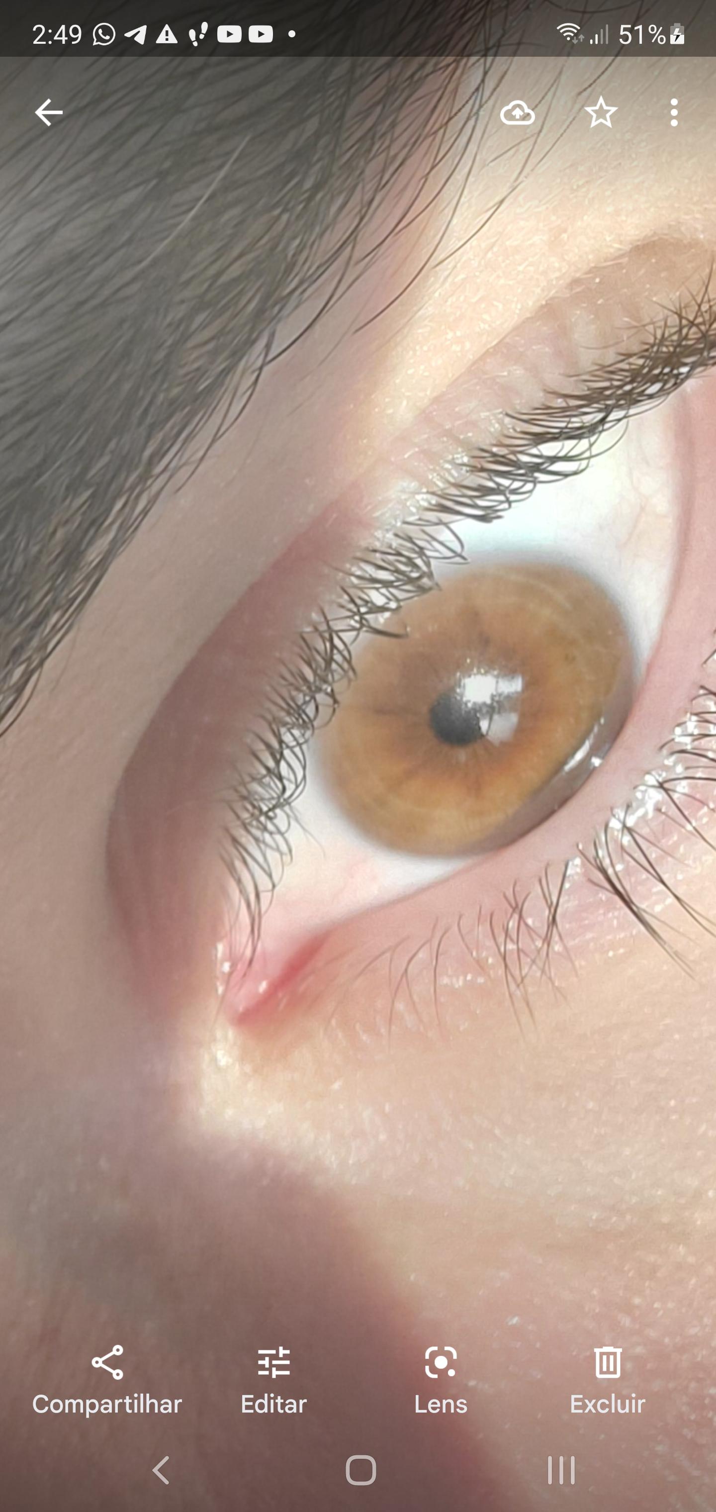 light brown, amber or hazel? | Scrolller