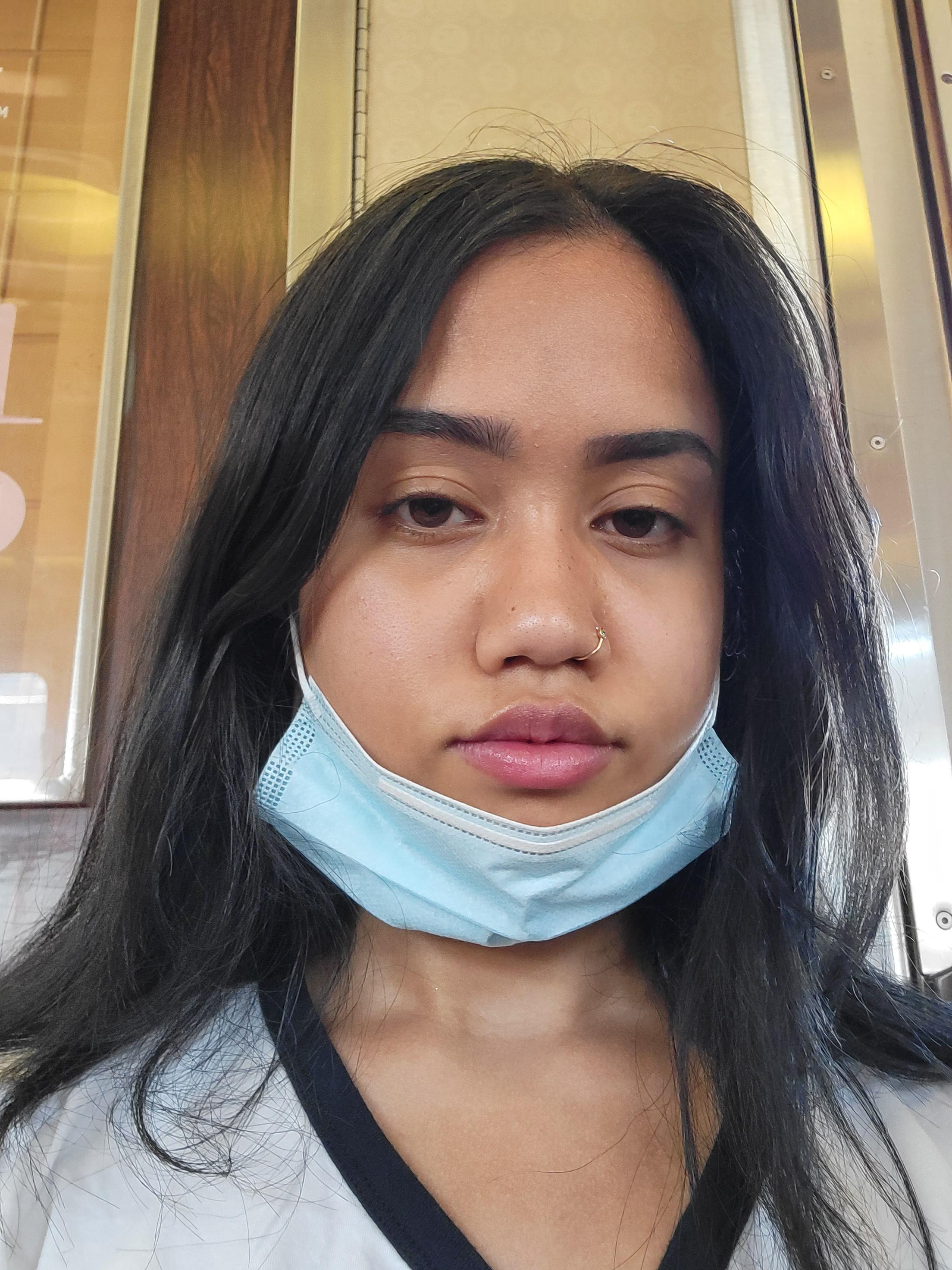 Lol diaper Chin | Scrolller