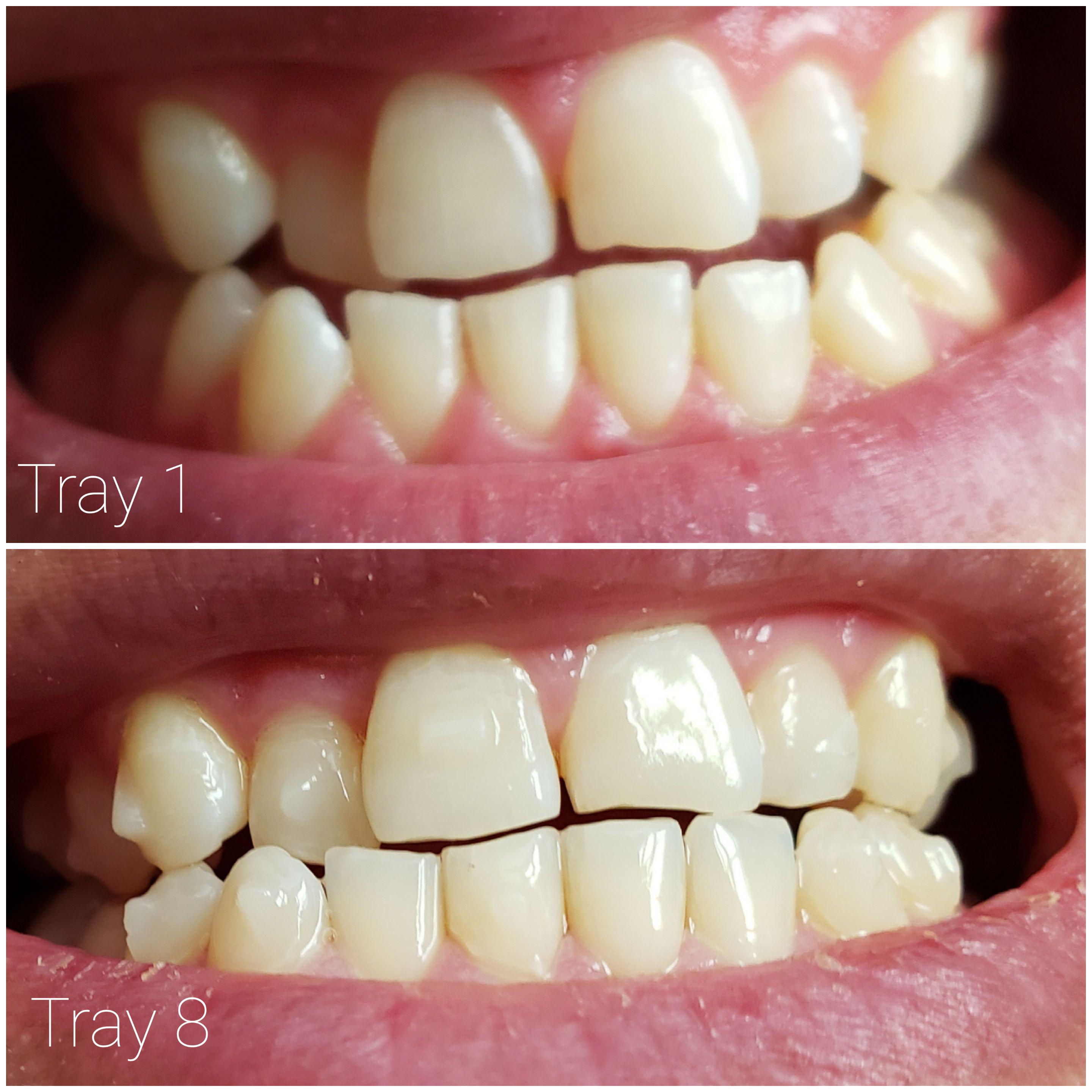 Loving the progress so far! | Scrolller