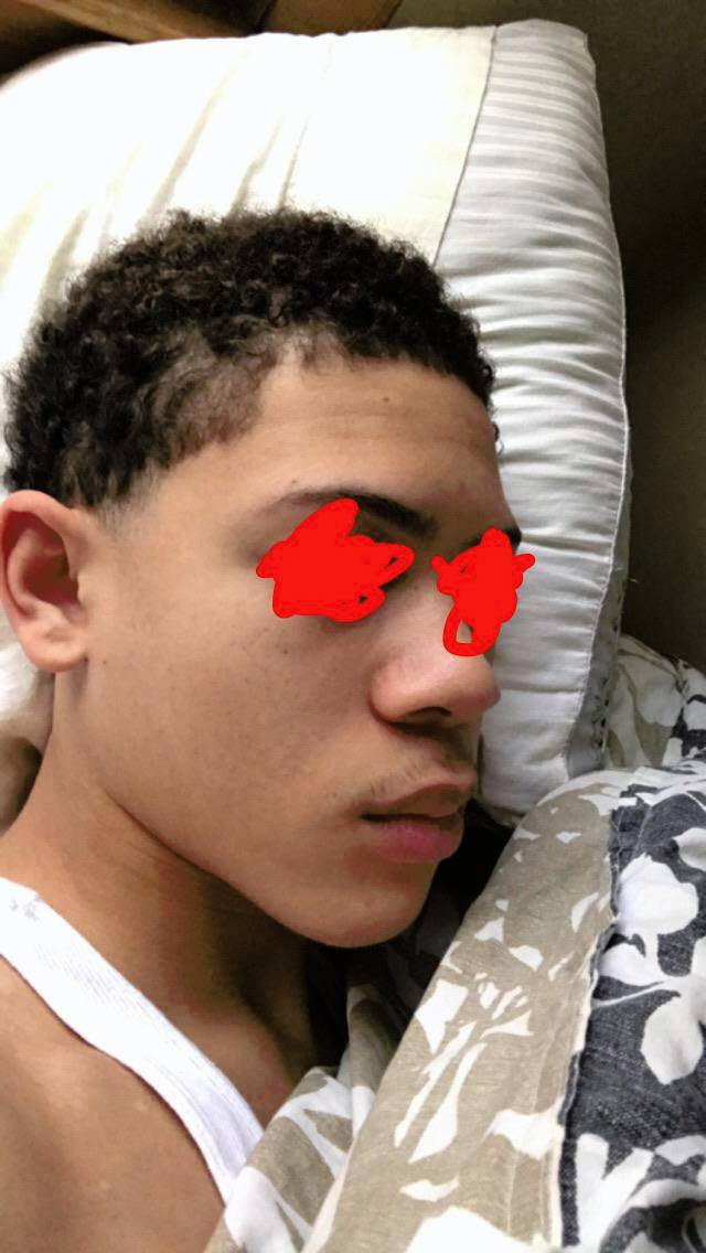 Mewing after two years progress and questions... | Scrolller