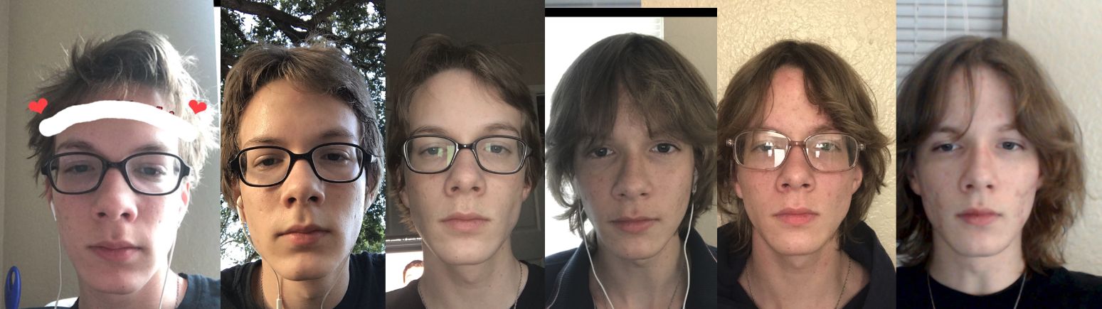 Mewing for 1 year | Scrolller