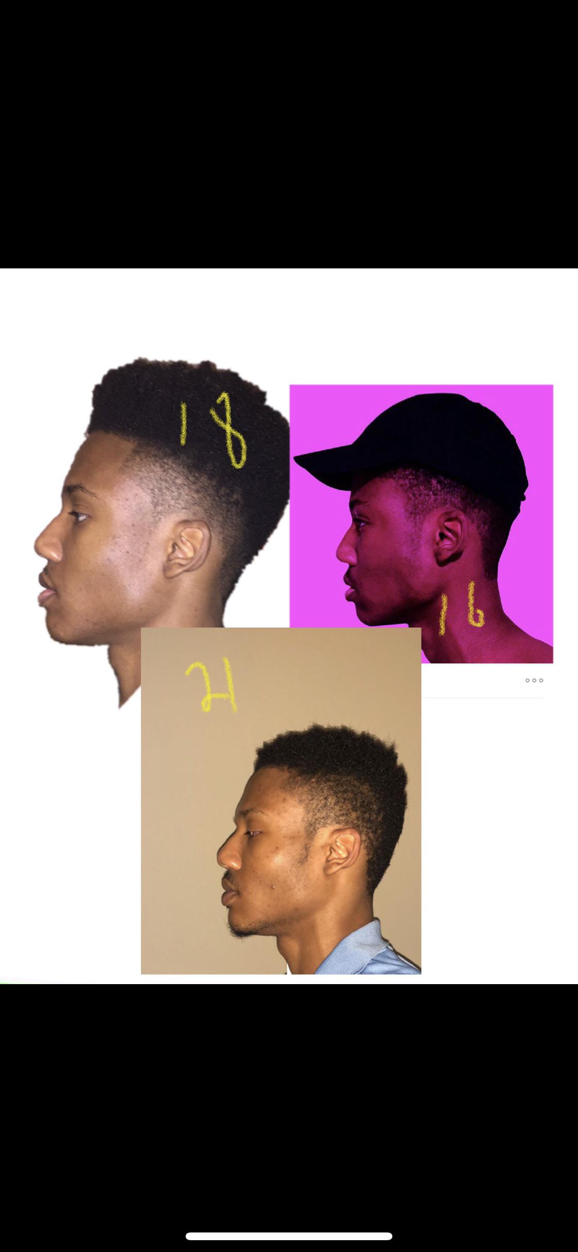 Age 16-21 mewing | Scrolller