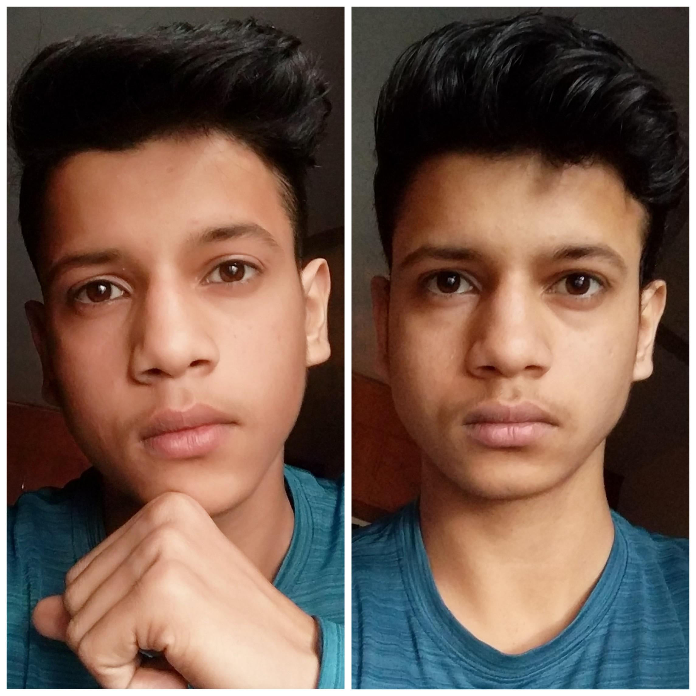 Mewing transformation 15 months | Scrolller