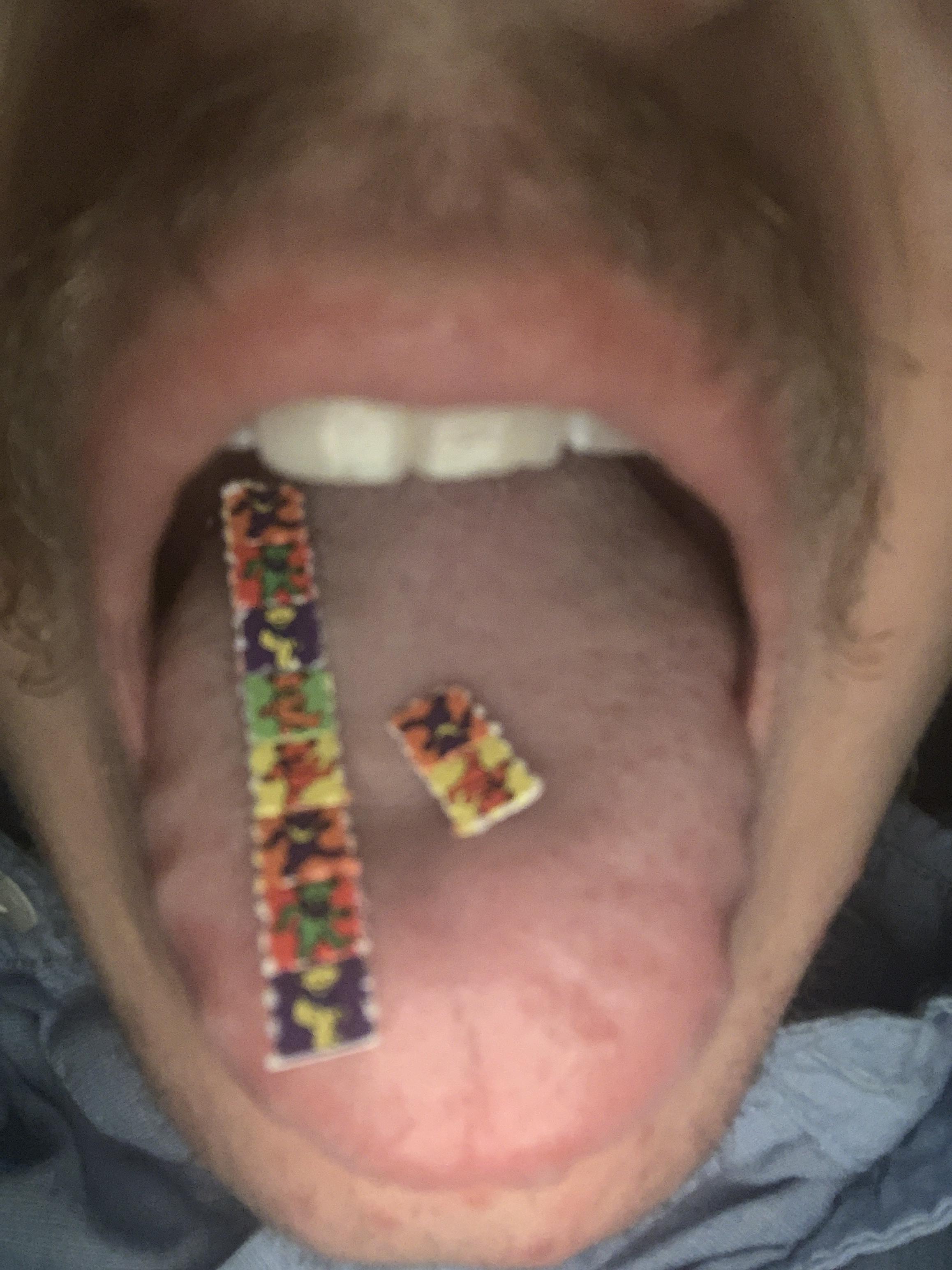 microdosing-on-10-ugs-for-the-first-time-an-ug-is-another-name-for-a