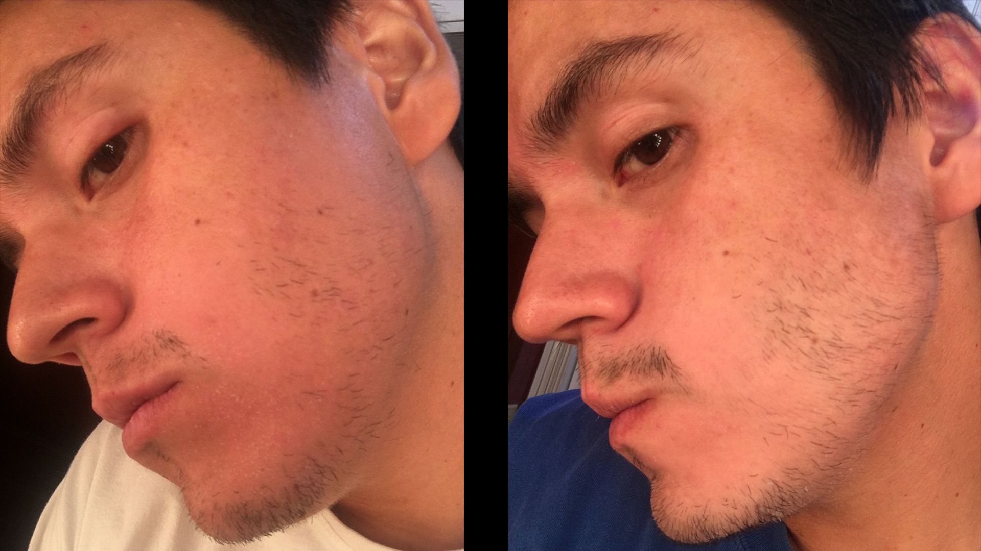 Minox day 2 vs day 34 | Scrolller
