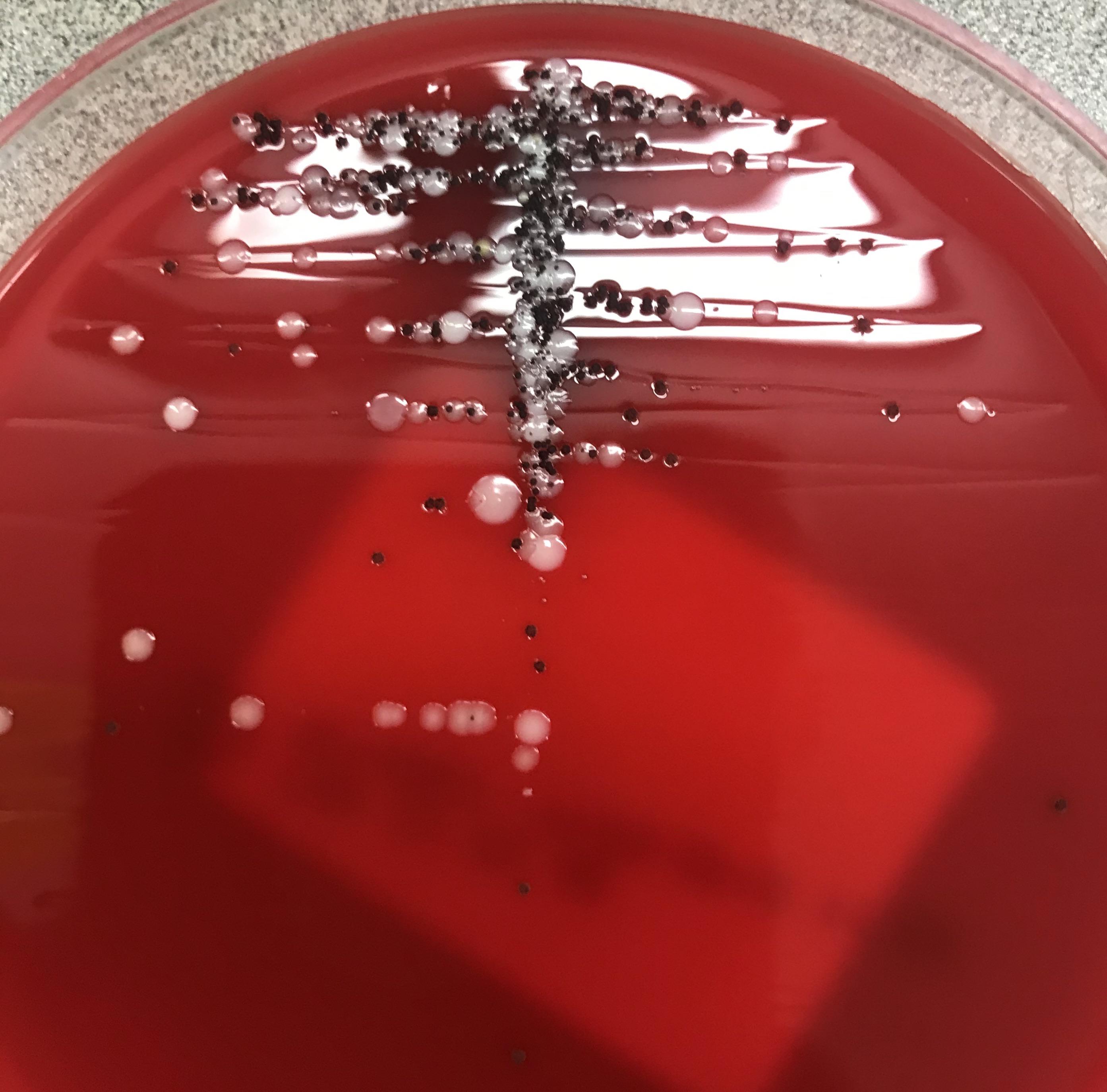 Mold growing on a Urine culture | Scrolller