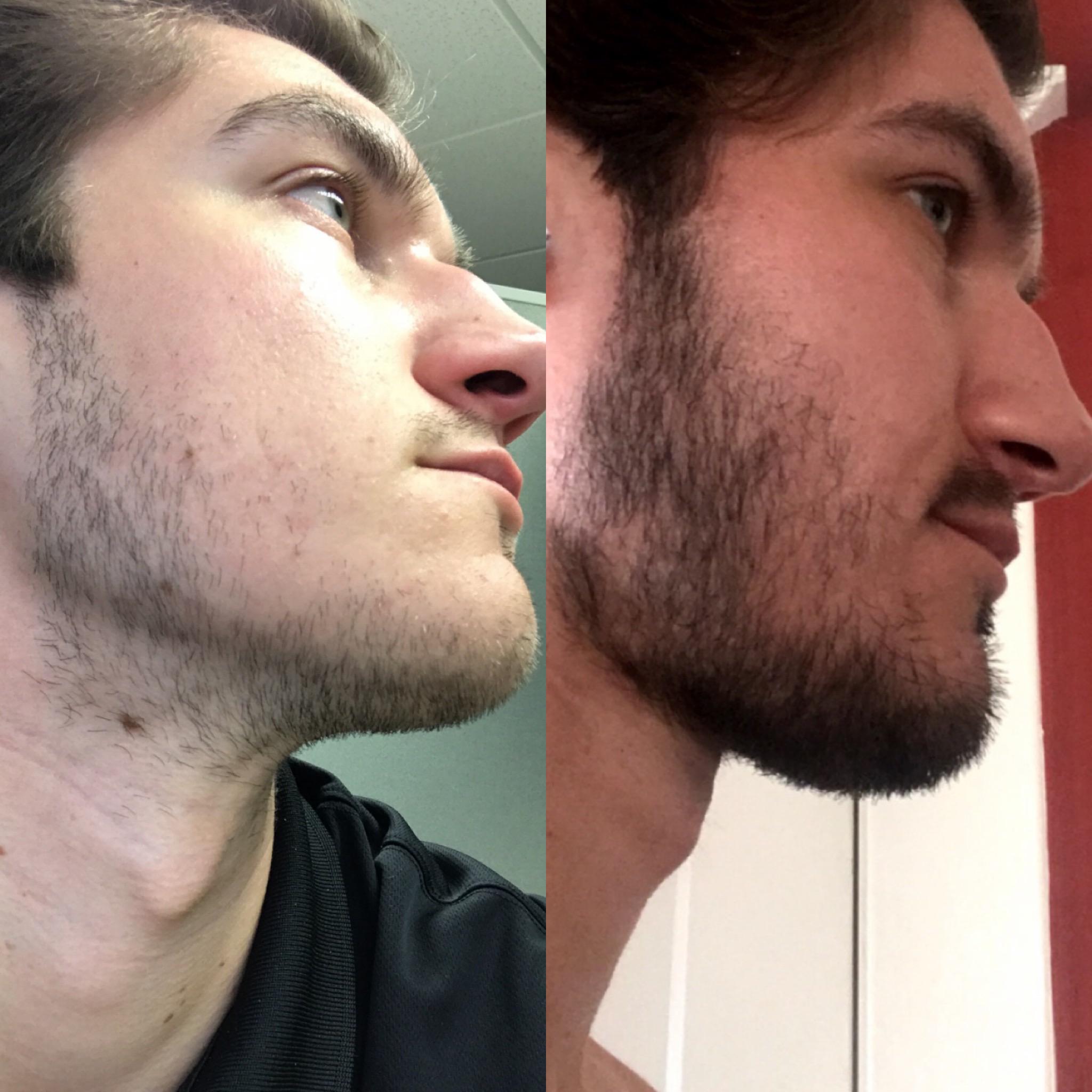 Month 0 vs. Month 3 | Scrolller