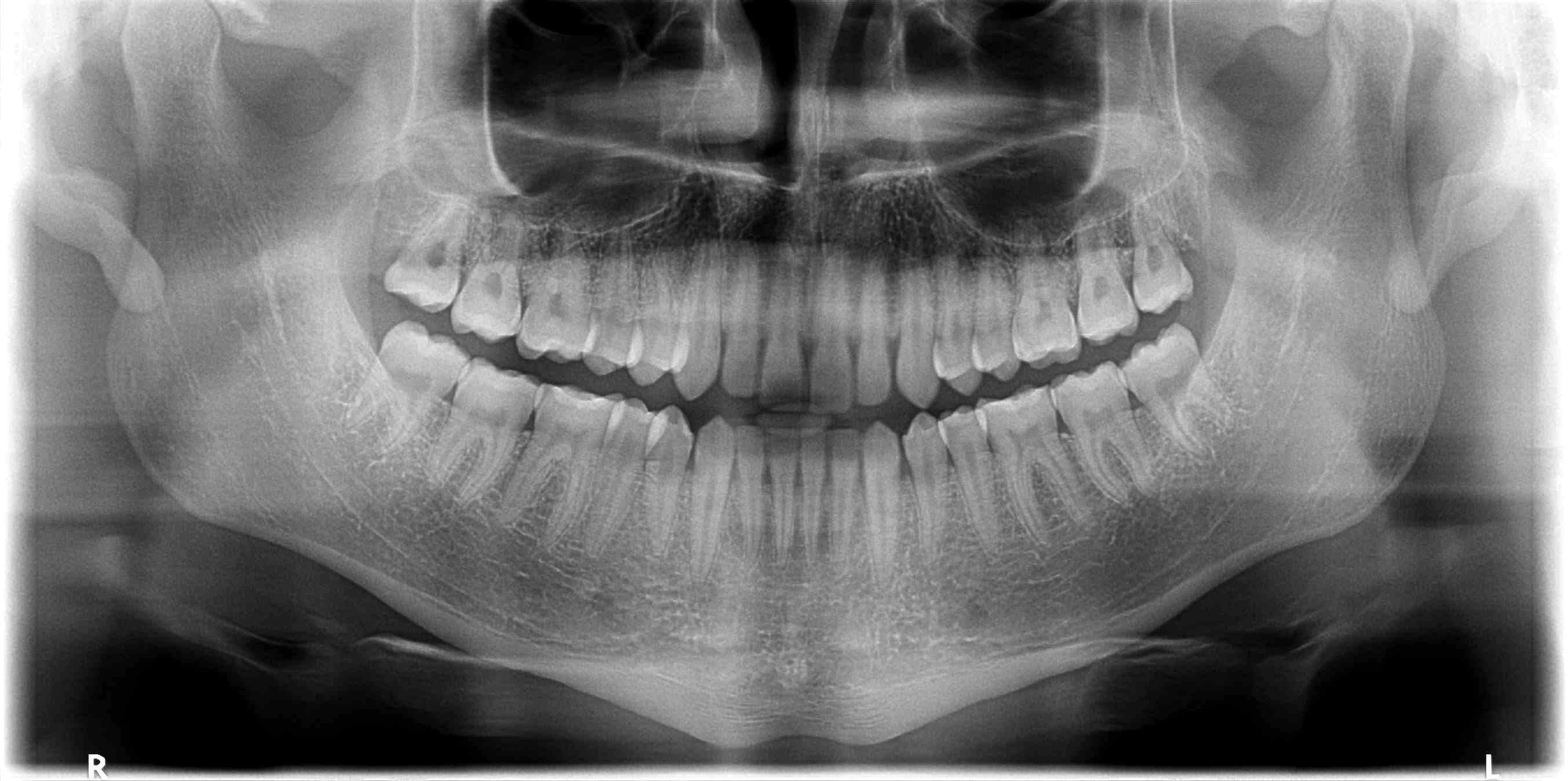 More teeth | Scrolller