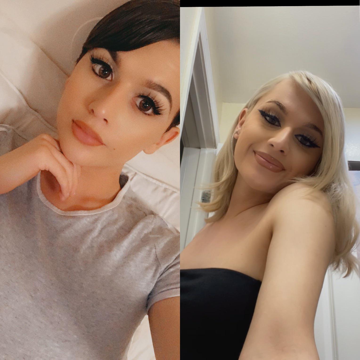 MtF Before vs after 9 months HRT | Scrolller