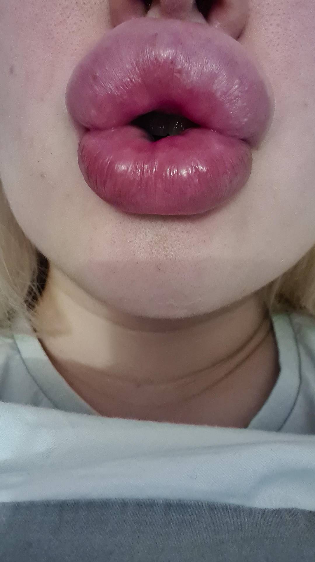 My freshly swollen lips💋 | Scrolller