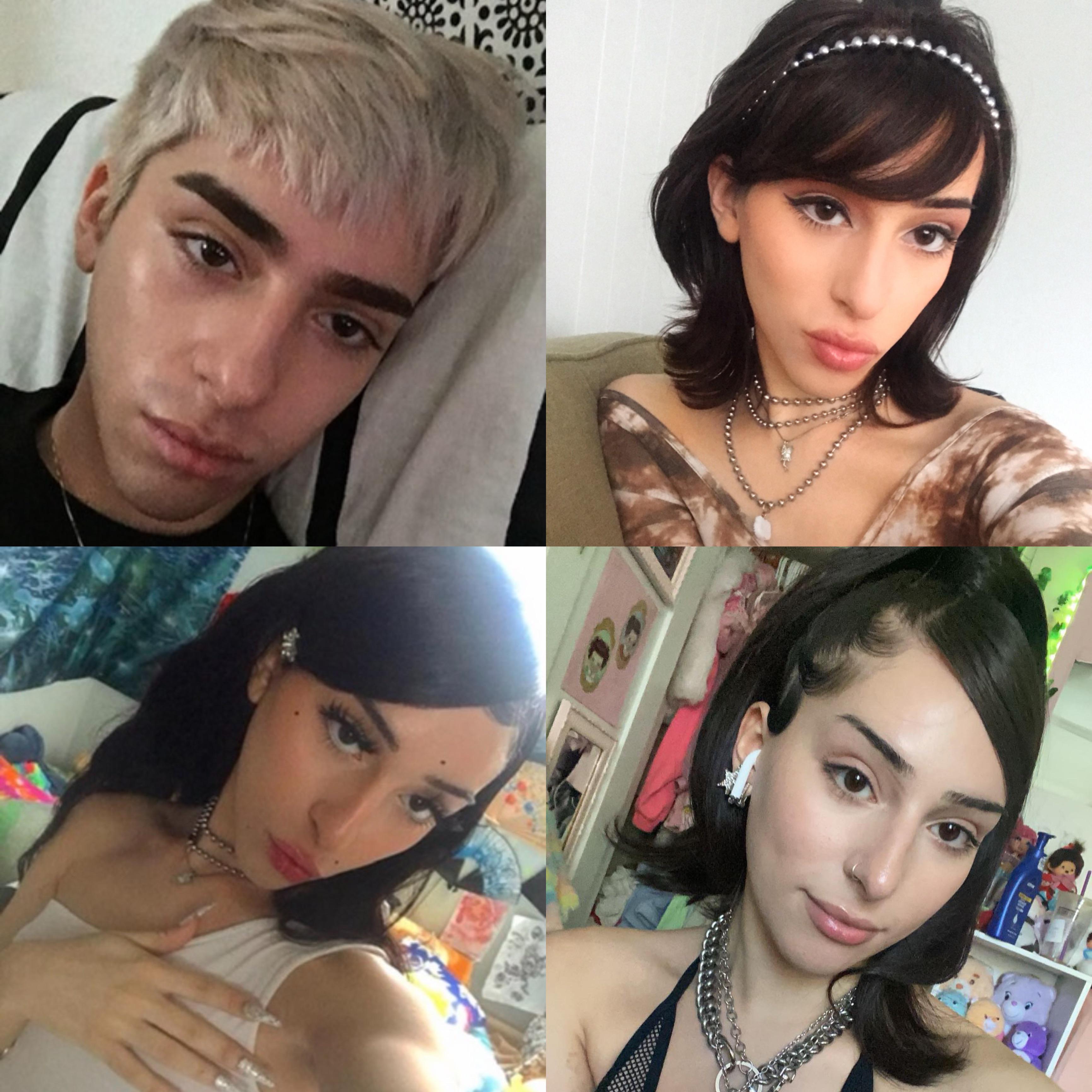 My HRT journey! 0 months HRT ; 5 months HRT ; 8 months and today I turned 1year & 8 months on ...