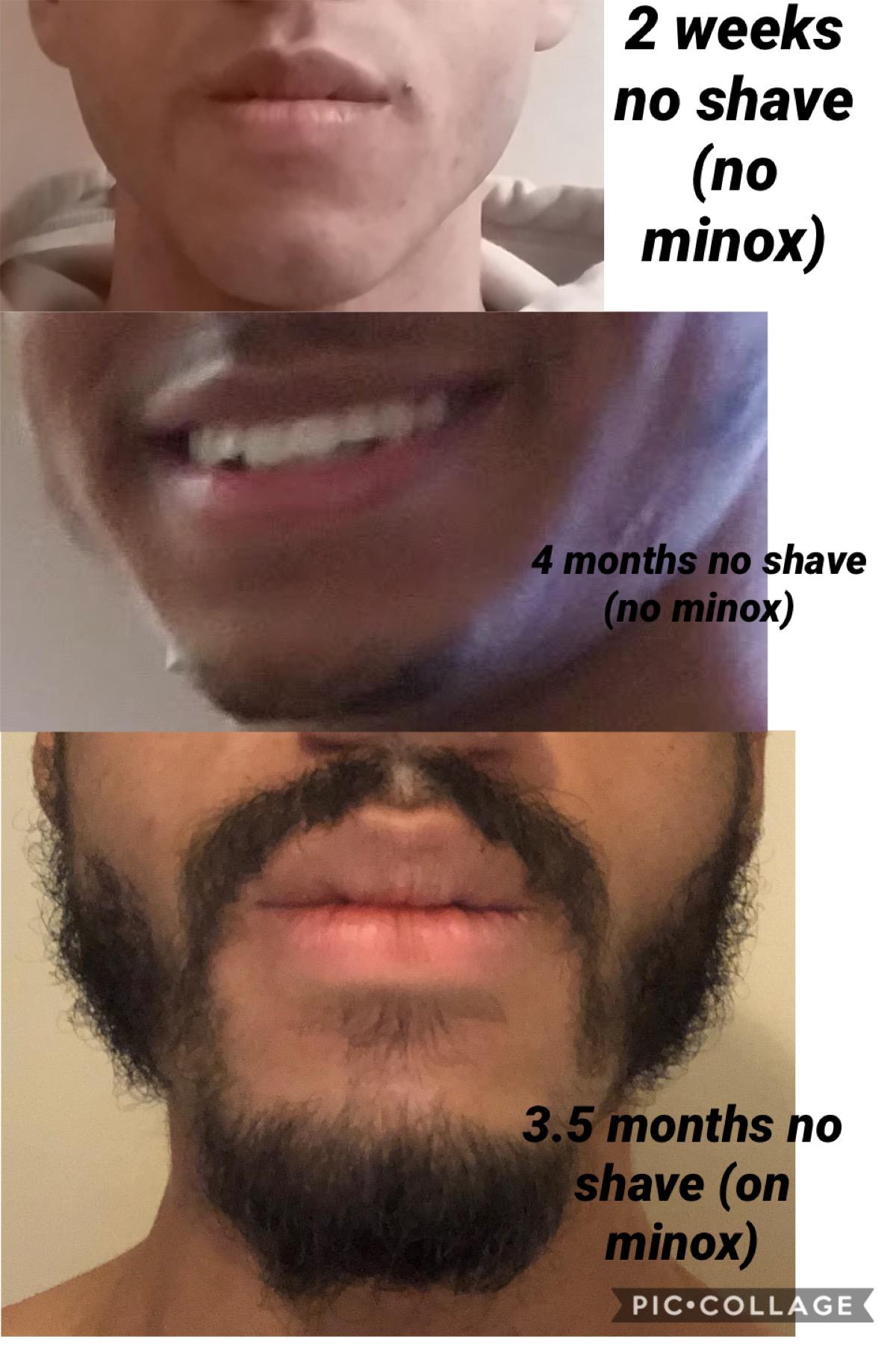 My Insane Minox Transformation | Scrolller