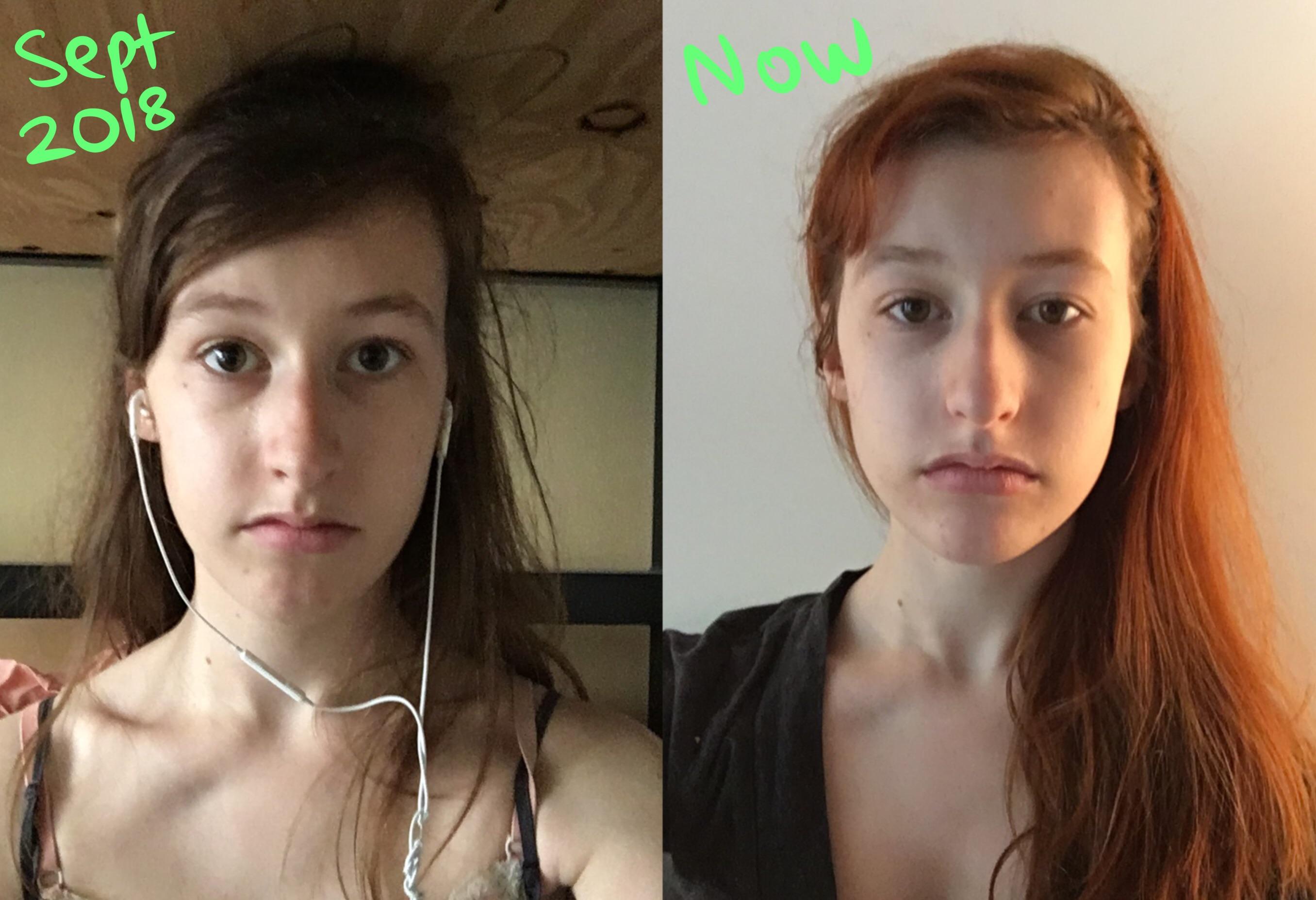 My progress so far.. :) | Scrolller