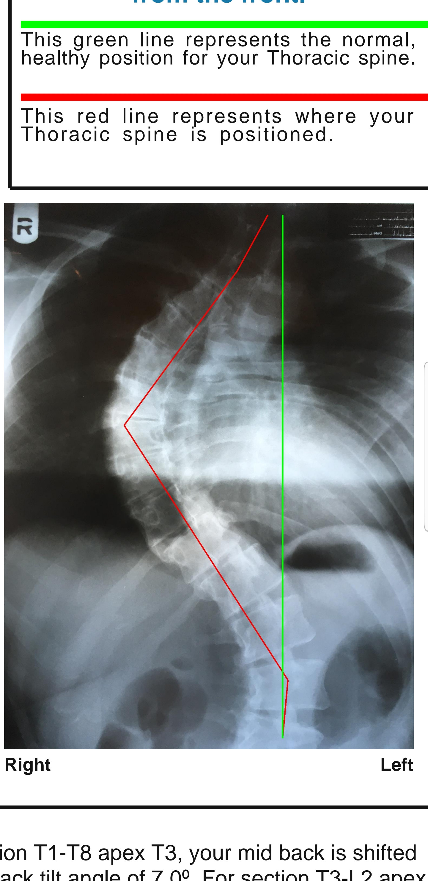 My spine is snek | Scrolller